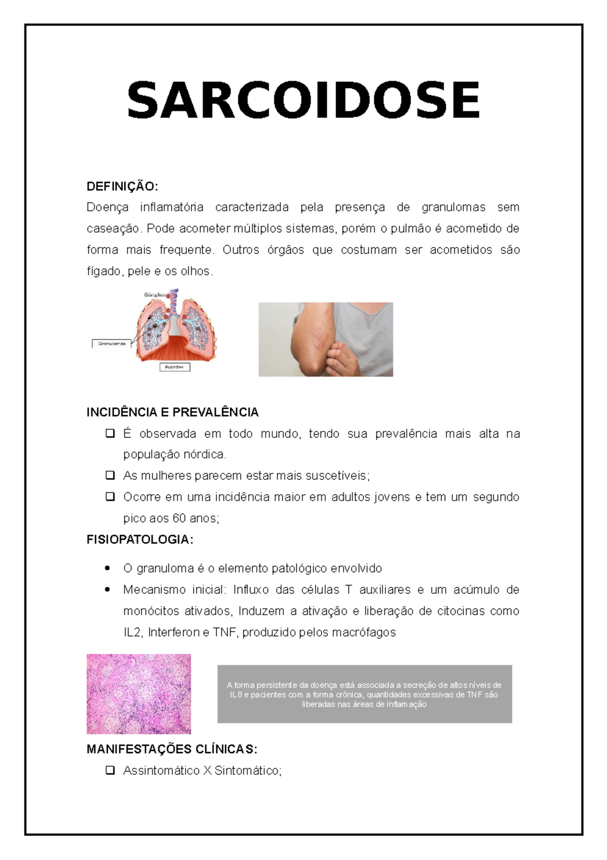 Sarcoidose - Introdução sobre a doença, epidemiologia, tipos e ...