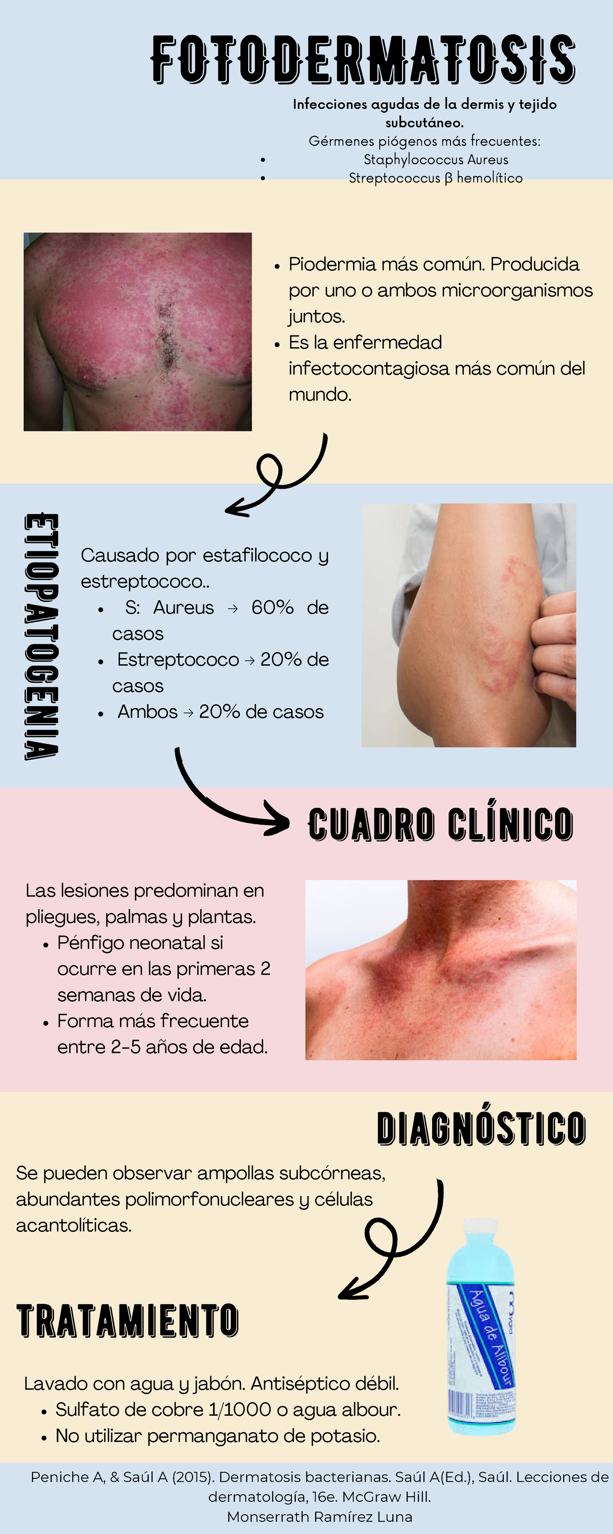 T13. Fotodermatosis - Fotofermatosis - Se pueden observar ampollas ...
