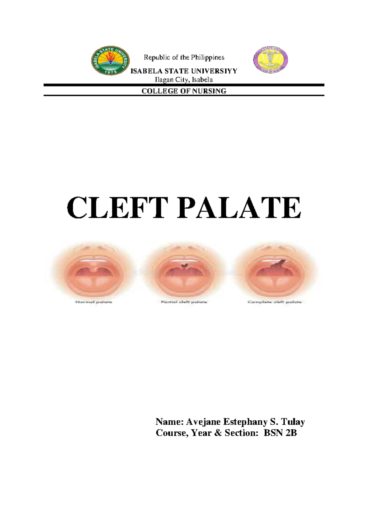 Cleft Palate - A medical-related lecture specifically on Maternal And ...
