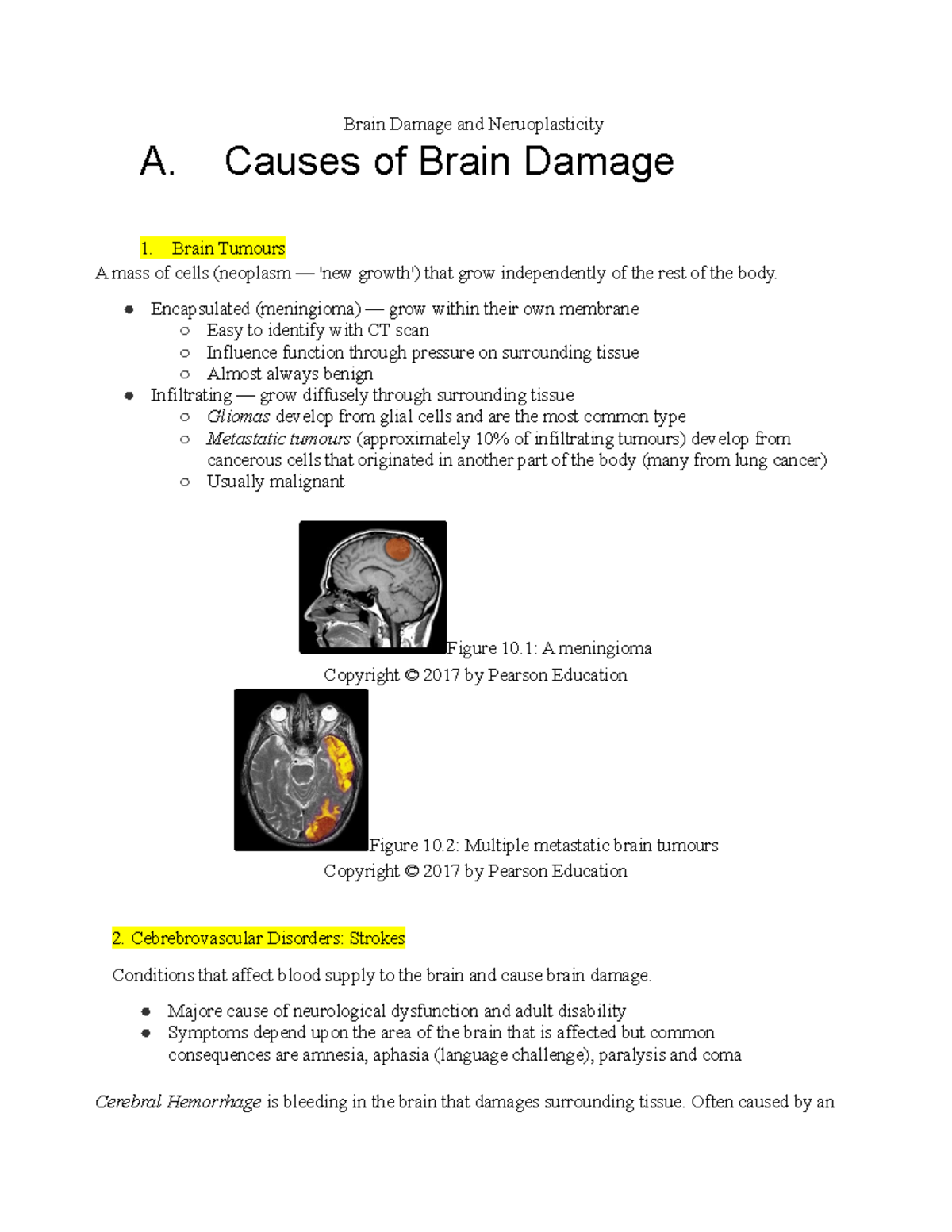 Neuroscience Lecture Notes - Brain Damage and Neruoplasticity A. Causes ...