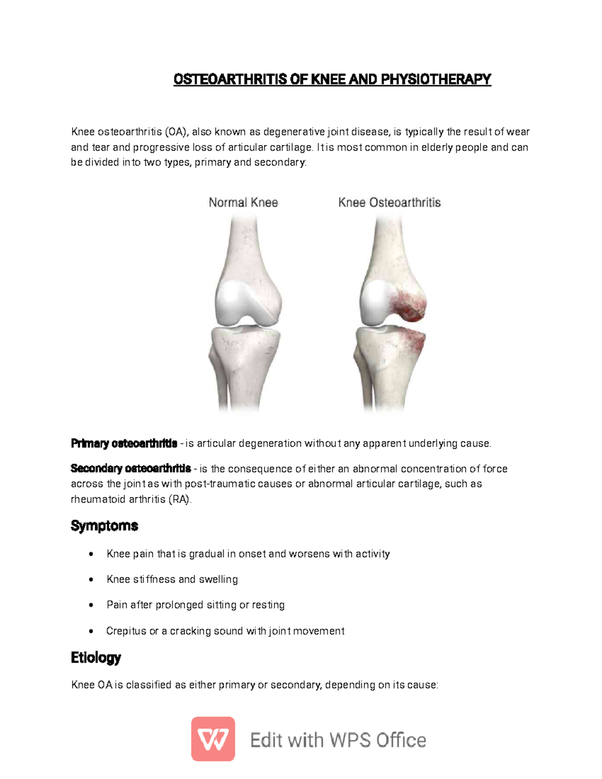 OA knee and physio - Osteoarthritis of knee - OSTEOARTHRITIS OF KNEE ...