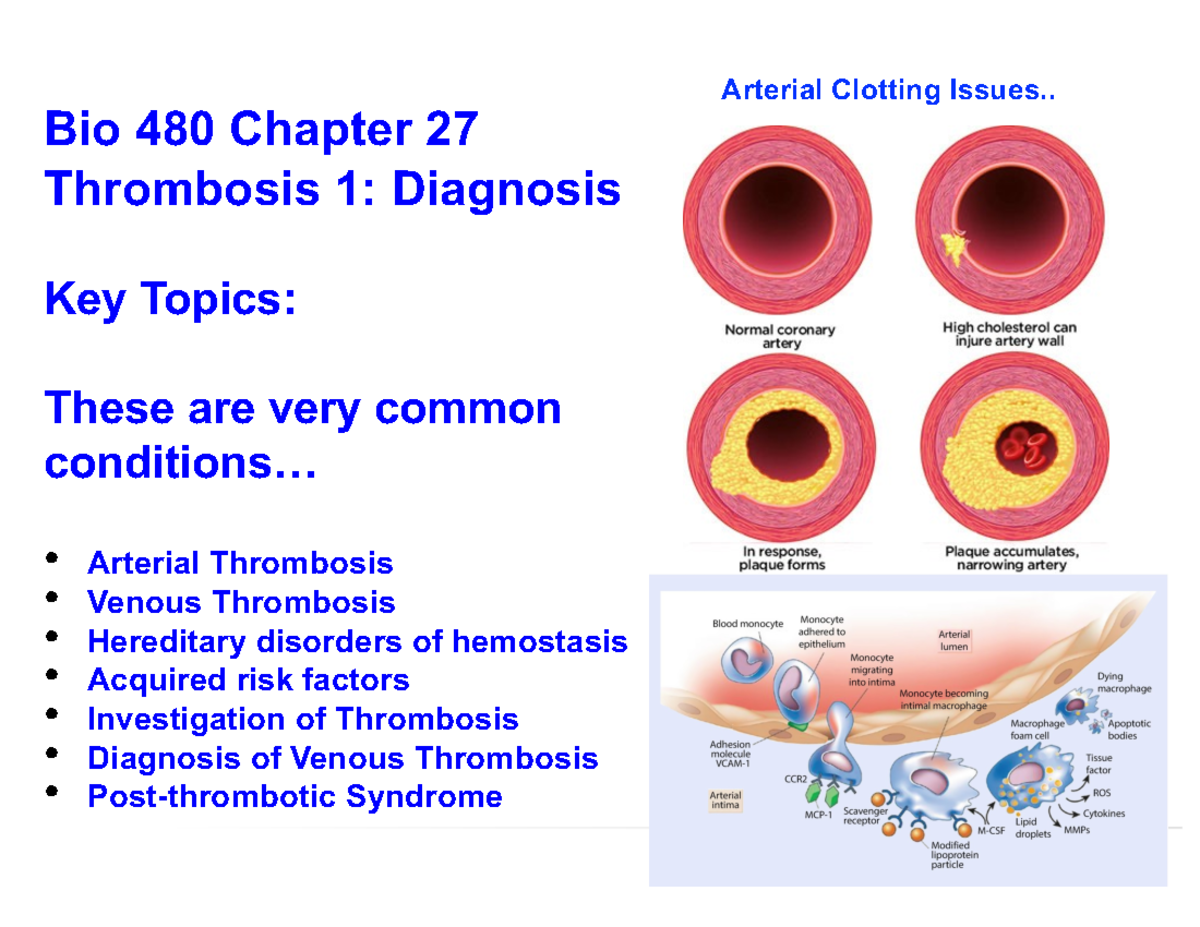 Ch 27 Thrombosis 1 Path-Diag S22 - Bio 480 Chapter 27 Thrombosis 1 ...