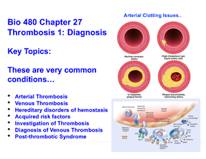 BIO480 Hematology - Chapter 14 Chronic Myeloid leukemia - Chronic ...