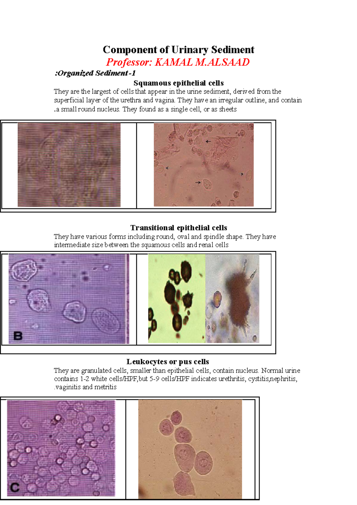 Componentof Urinary Sediment 1111111 - Component of Urinary Sediment ...