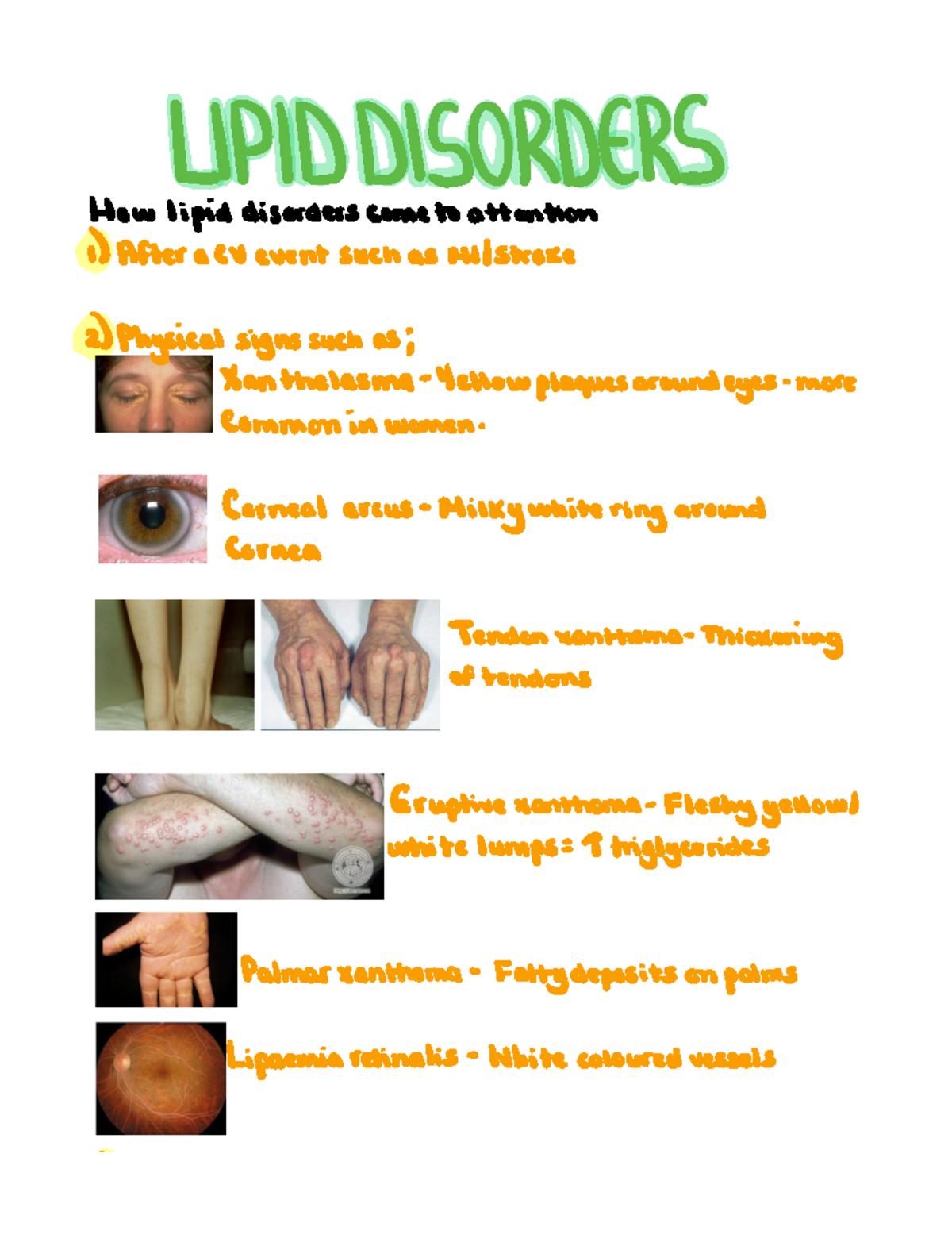 Lipid disorders - Pathology - LIPID DISORDERS ####### How lipid ...