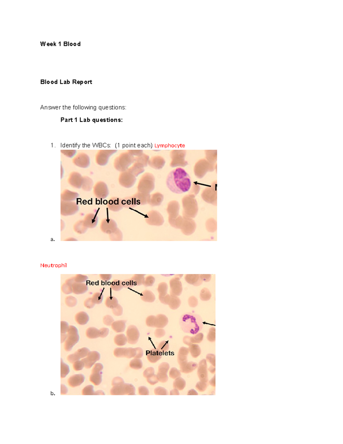 A&P3 Week 1 Lab Doc - Week 1 Blood Blood Lab Report Answer the ...