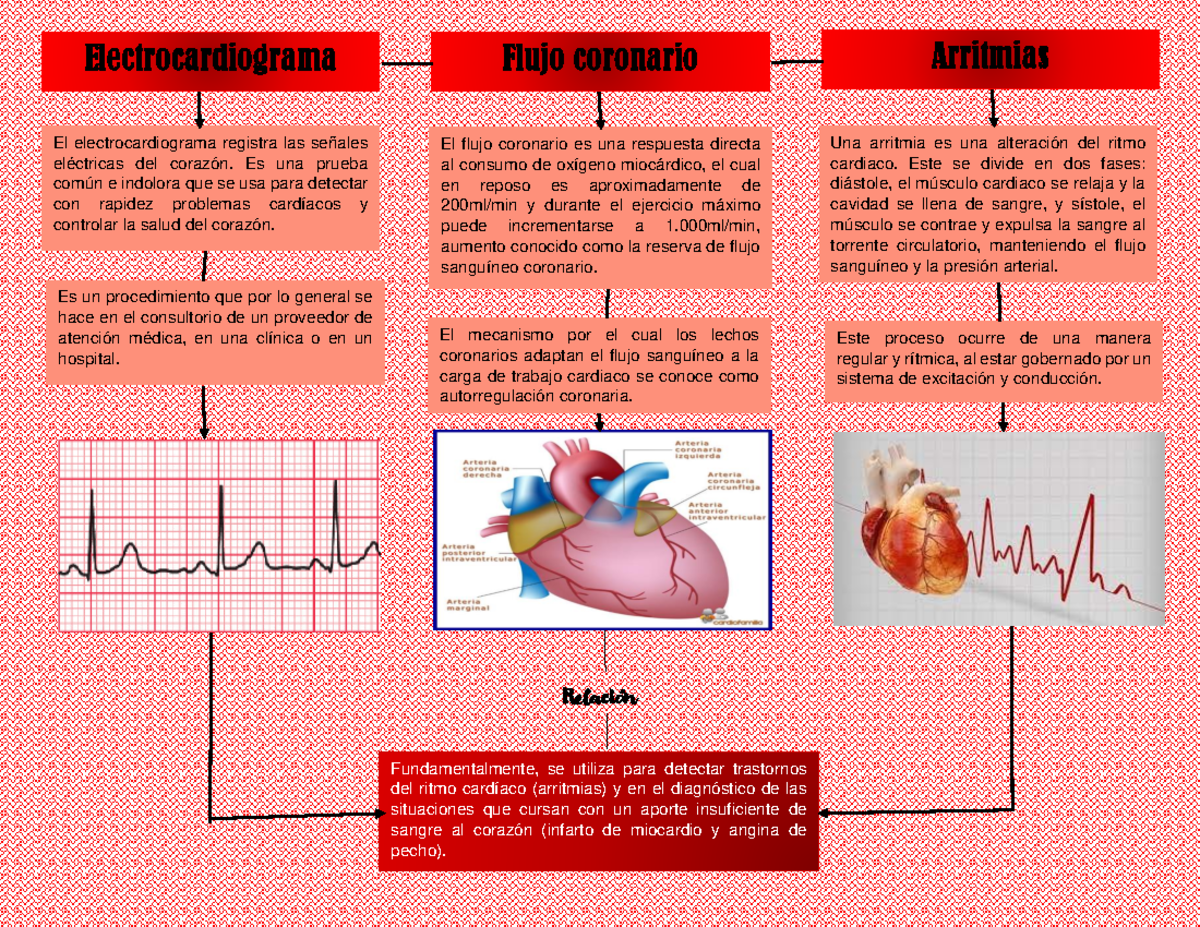EKG, Flujo coronario y arrirtmias-Relación - Electrocardiograma Flujo ...