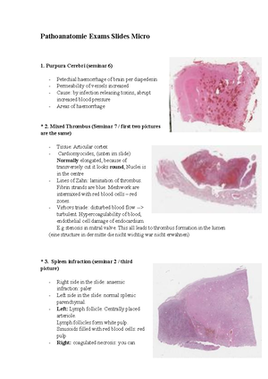 Pathoanatomy 4 - MCQ - Pathoanatomy 4 Hemorrhagic diathesis typically ...