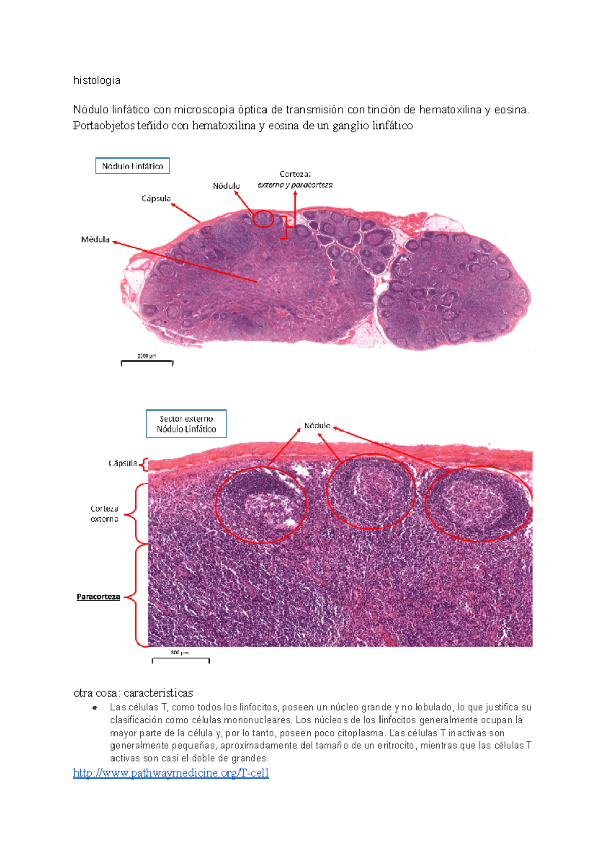 Histologia nodulo linfatico - histologia Nódulo linfático con ...