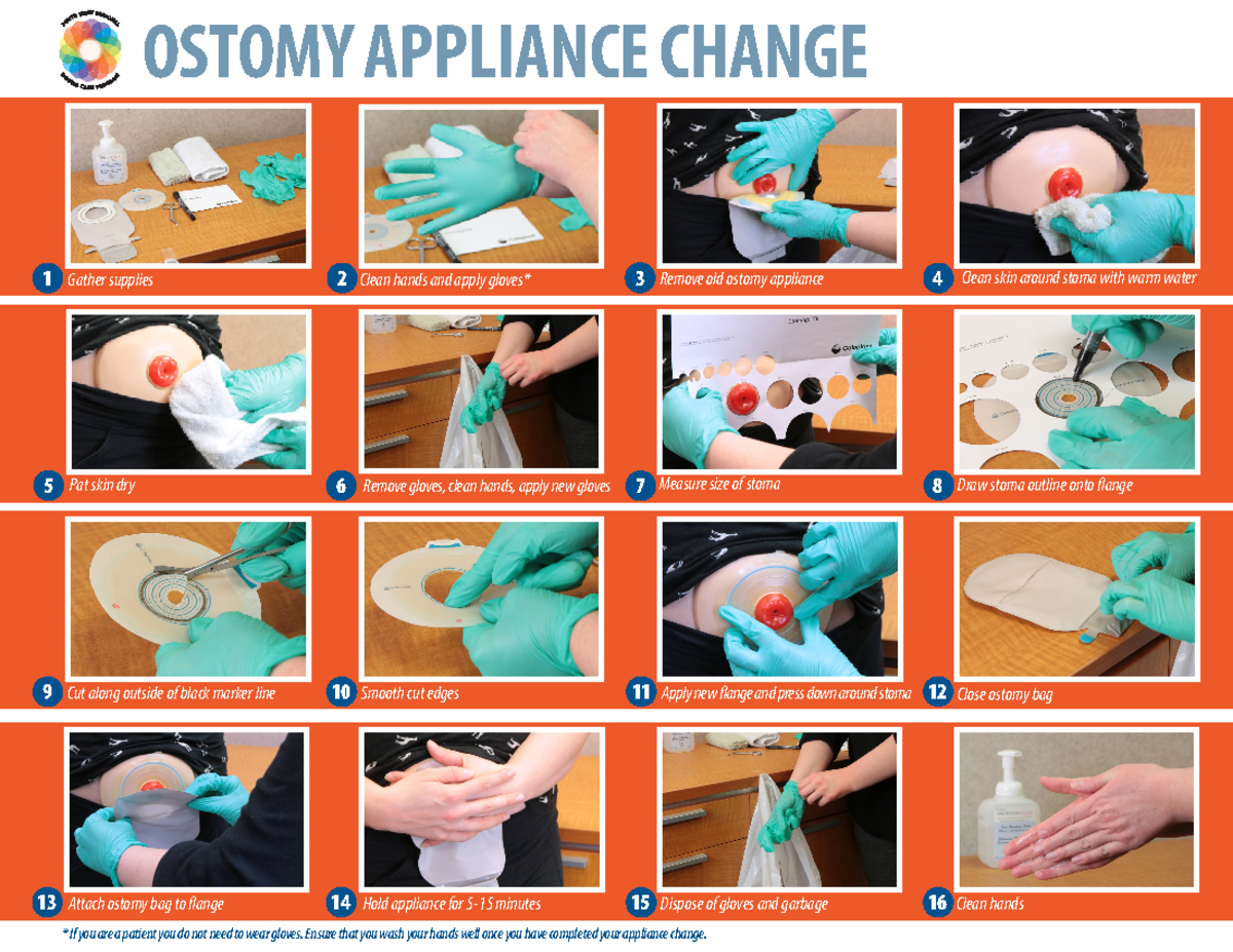 Ostomyappliance v3 - Ostomy - OSTOMY APPLIANCE CHANGE South West ...