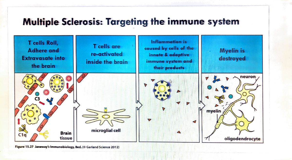 Summary for microbes lectures and multiple sclerosis - Multi·ple ...