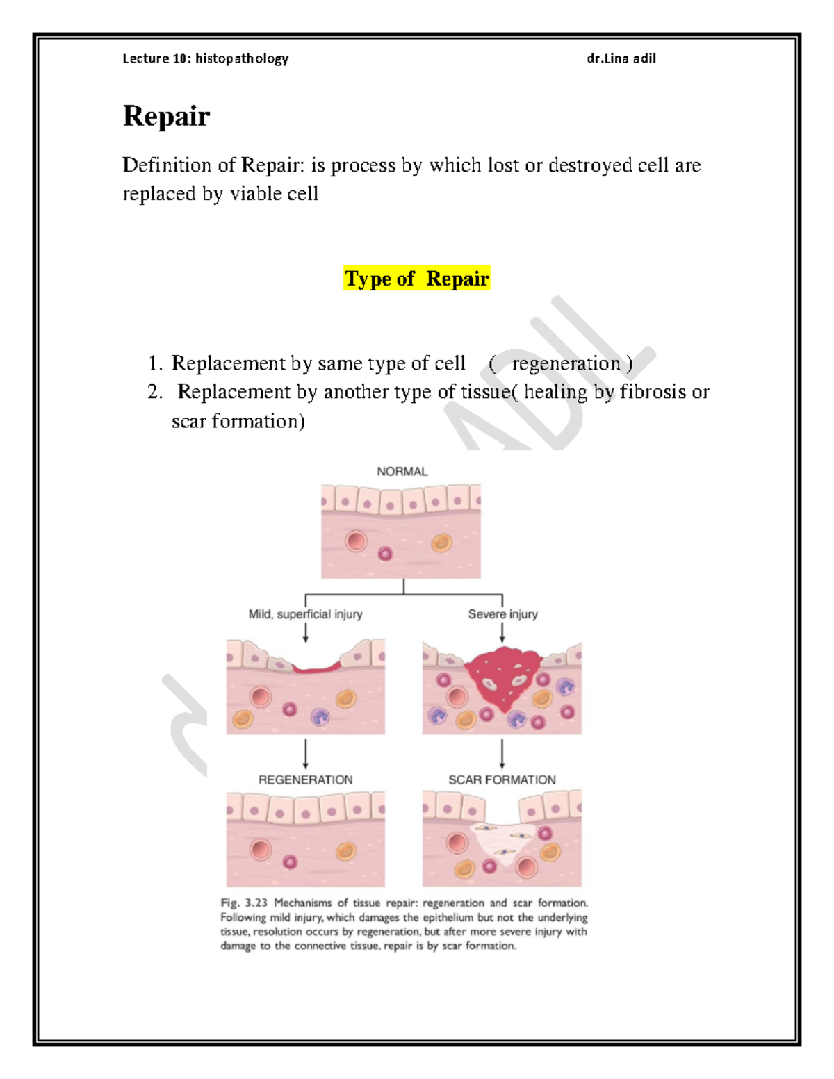 Repair - Histopathology - Repair Definition of Repair: is process by ...