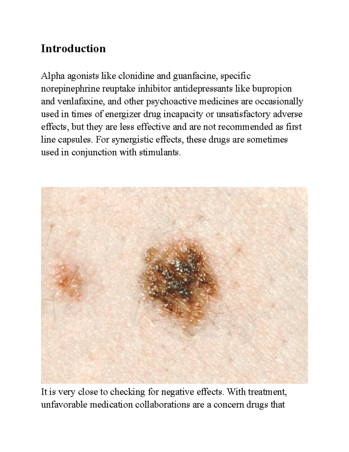 Moles pathology - Introduction Alpha agonists like clonidine and ...
