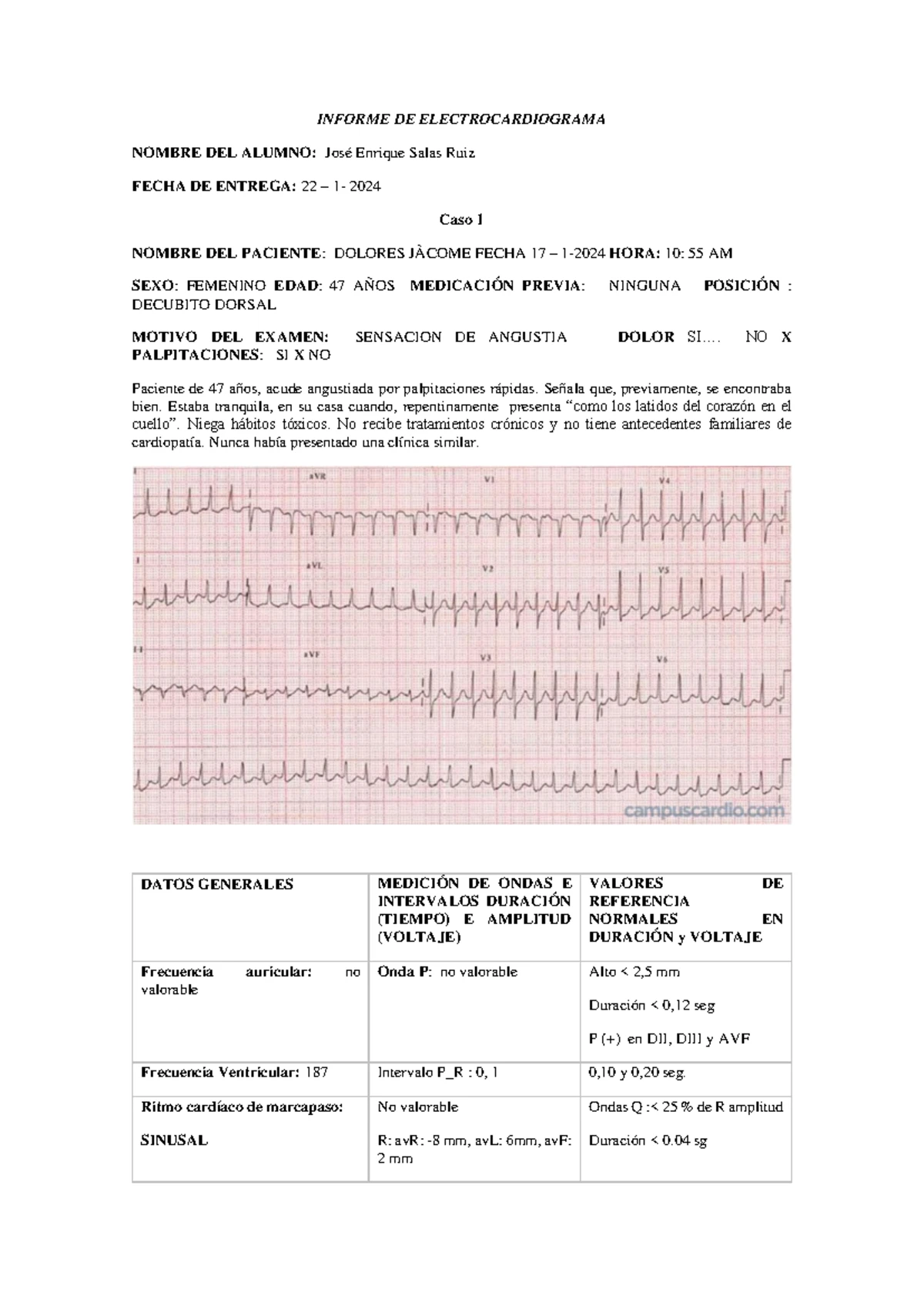 Informe DE Electrocardiograma-JOSE Salas - INFORME DE ...