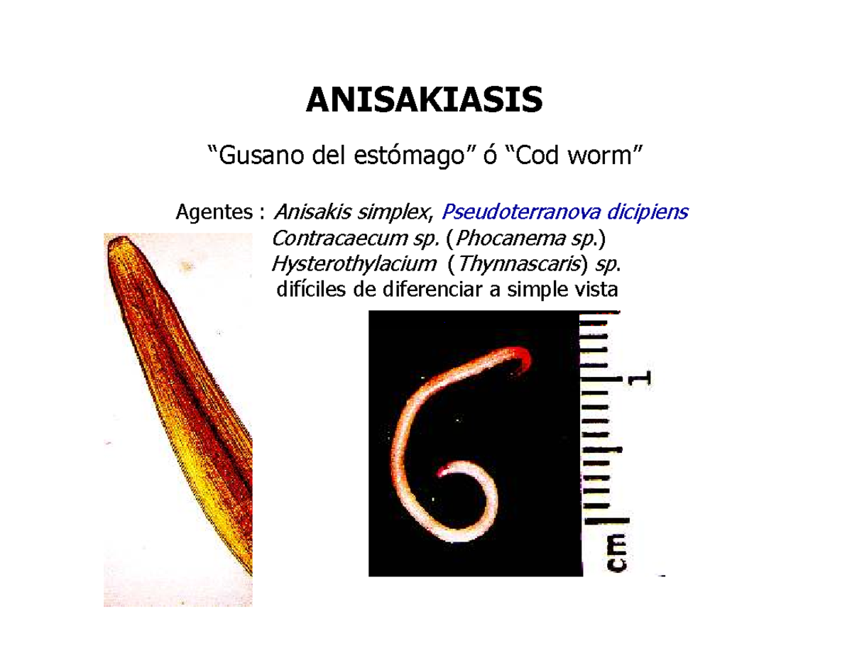 Clase - Anisakiasis - ANISAKIASIS “Gusano del estómago” ó “Cod worm ...