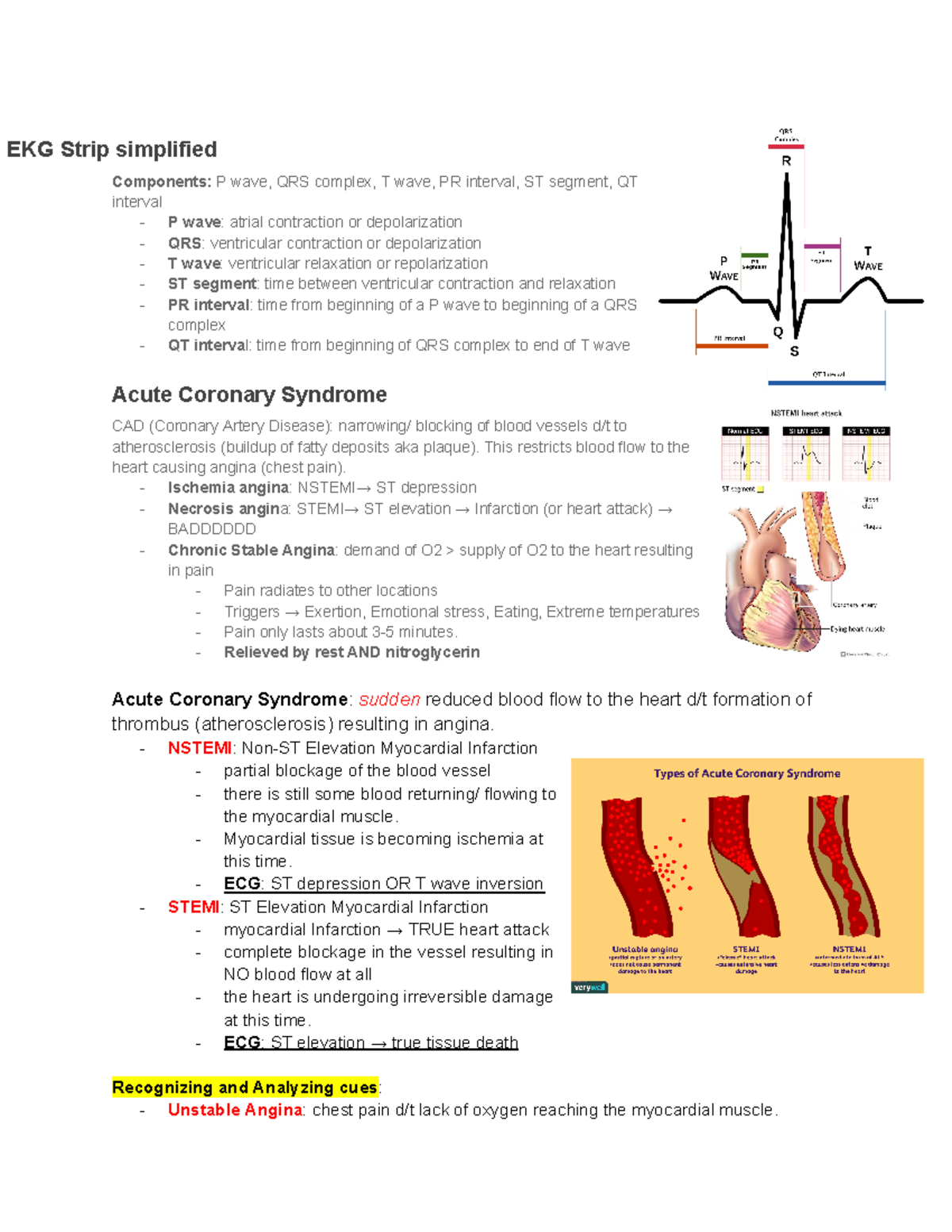 Quiz 2- cardiac + neuro - EKG Strip simplified Components: P wave, QRS ...
