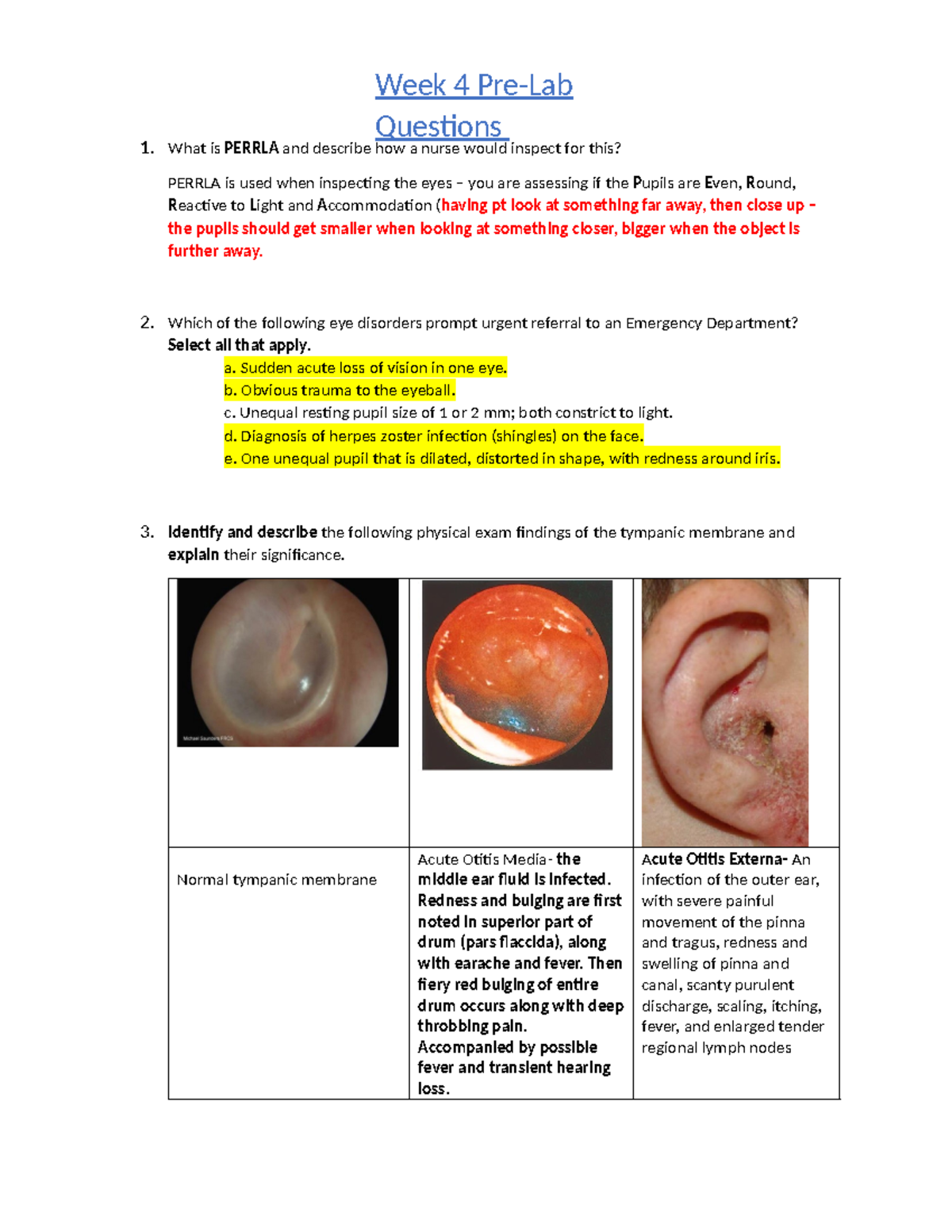 Week 4 Pre-Lab Questions - 1. What is PERRLA and describe how a nurse ...