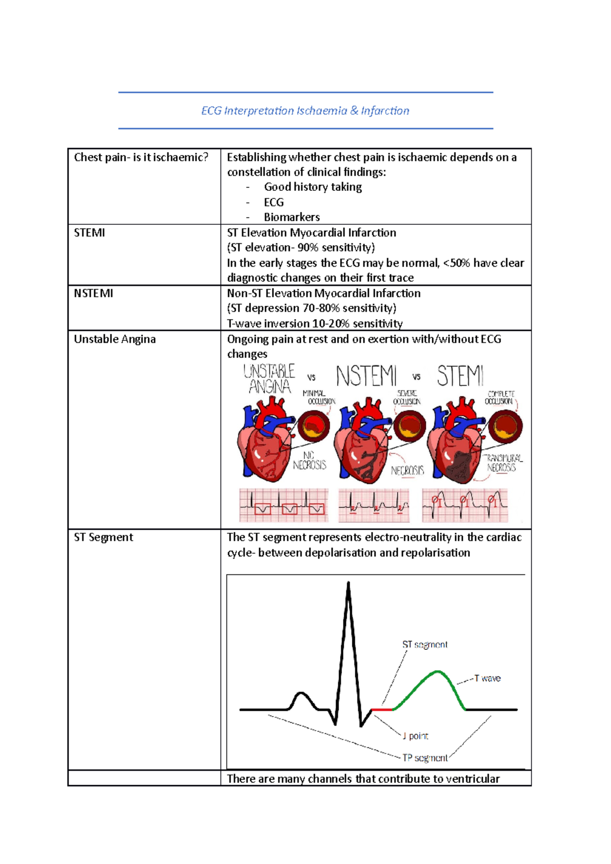 ECG Interpretation Ischaemia - Remember ATP is an energy carrying ...