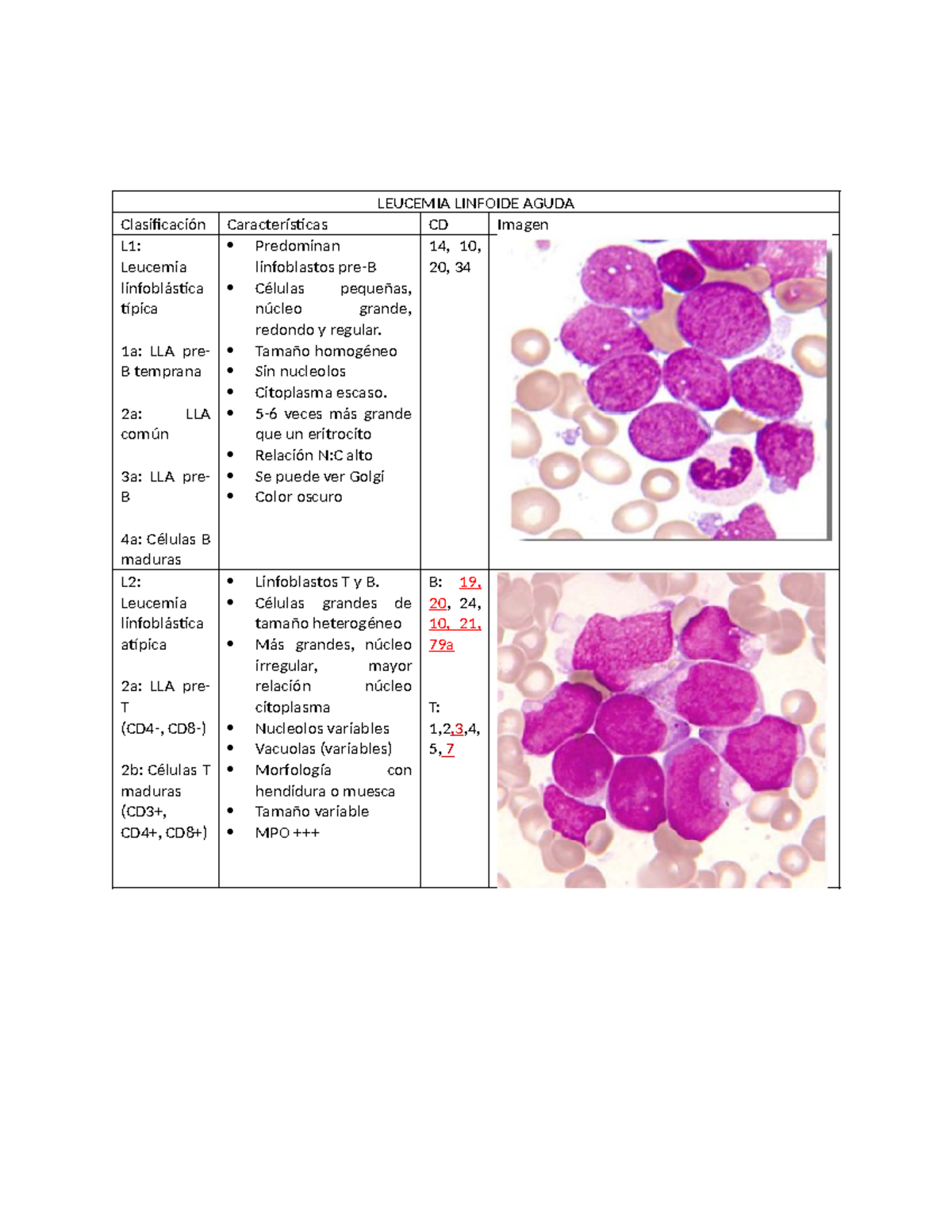 Clasificacíon LLA - practica 5 diureticos - LEUCEMIA LINFOIDE AGUDA ...