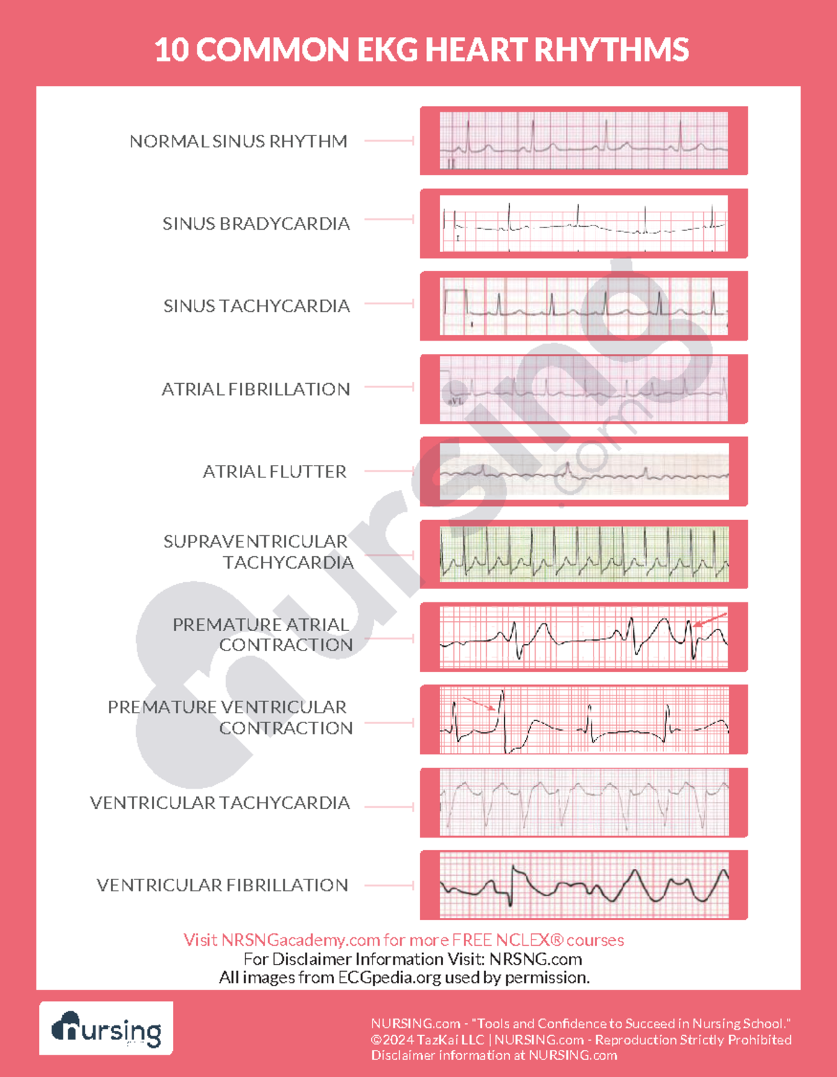 Cs-cardiac-002-10 common ekg heart rhythms - NURSING - "Tools and ...