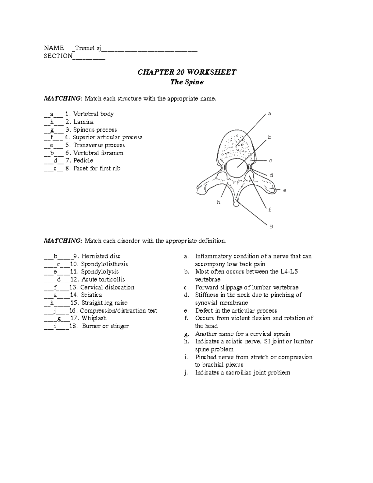 Spine assignment - NAME Tremel sj____________________________ SECTION ...