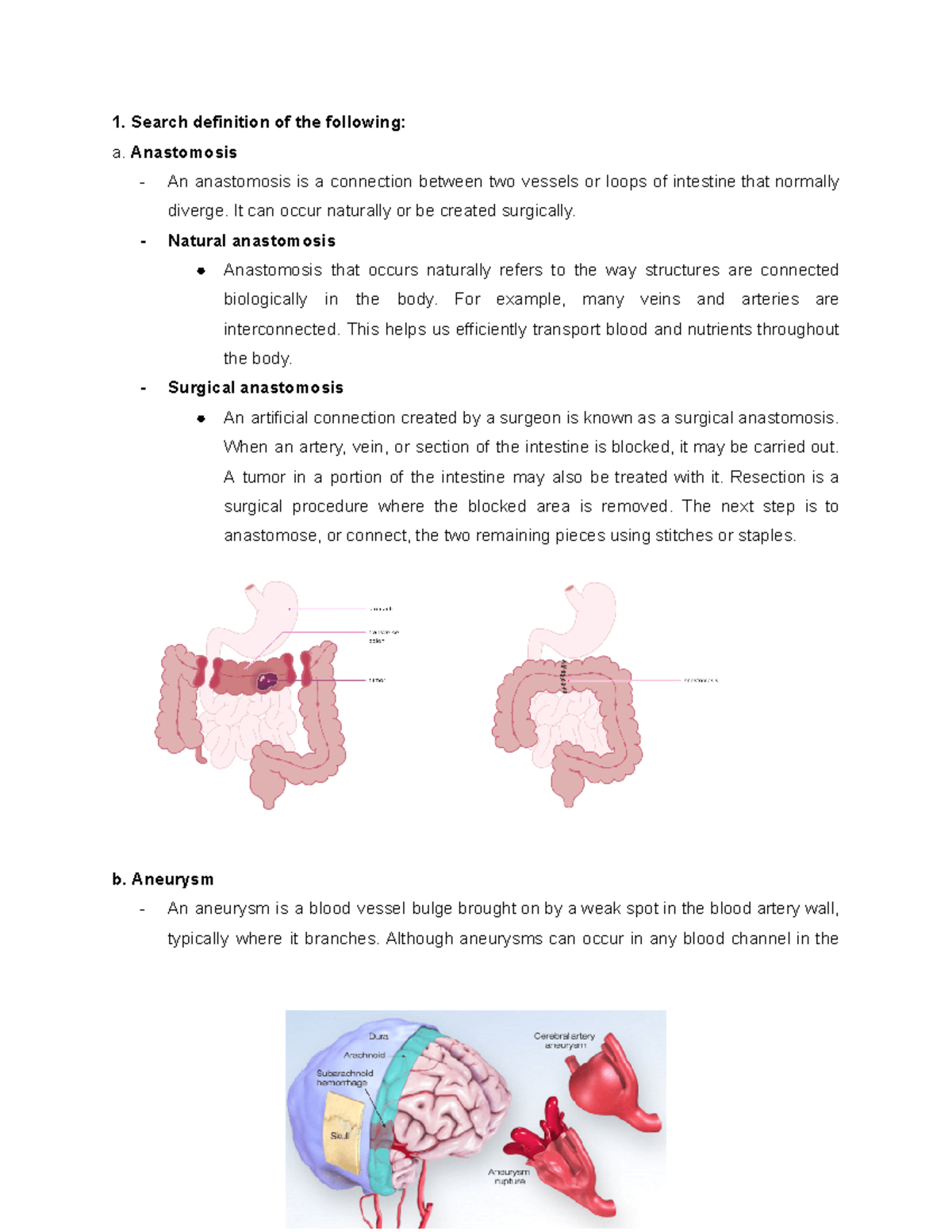 Peripheral Vascular Disorder - Search definition of the following: a ...