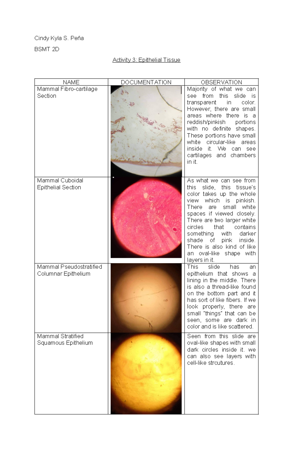 Activity 3 - Epithelial Tissue - Cindy Kyla S. Peña BSMT 2D Activity 3 ...