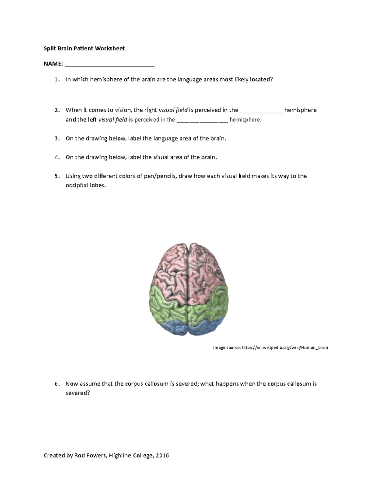 Split brain worksheet - motes - Split Brain Patient Worksheet NAME