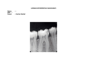 Interpretasi Radiografi kista odontogenik 1 - LEMBAR INTERPRETASI ...