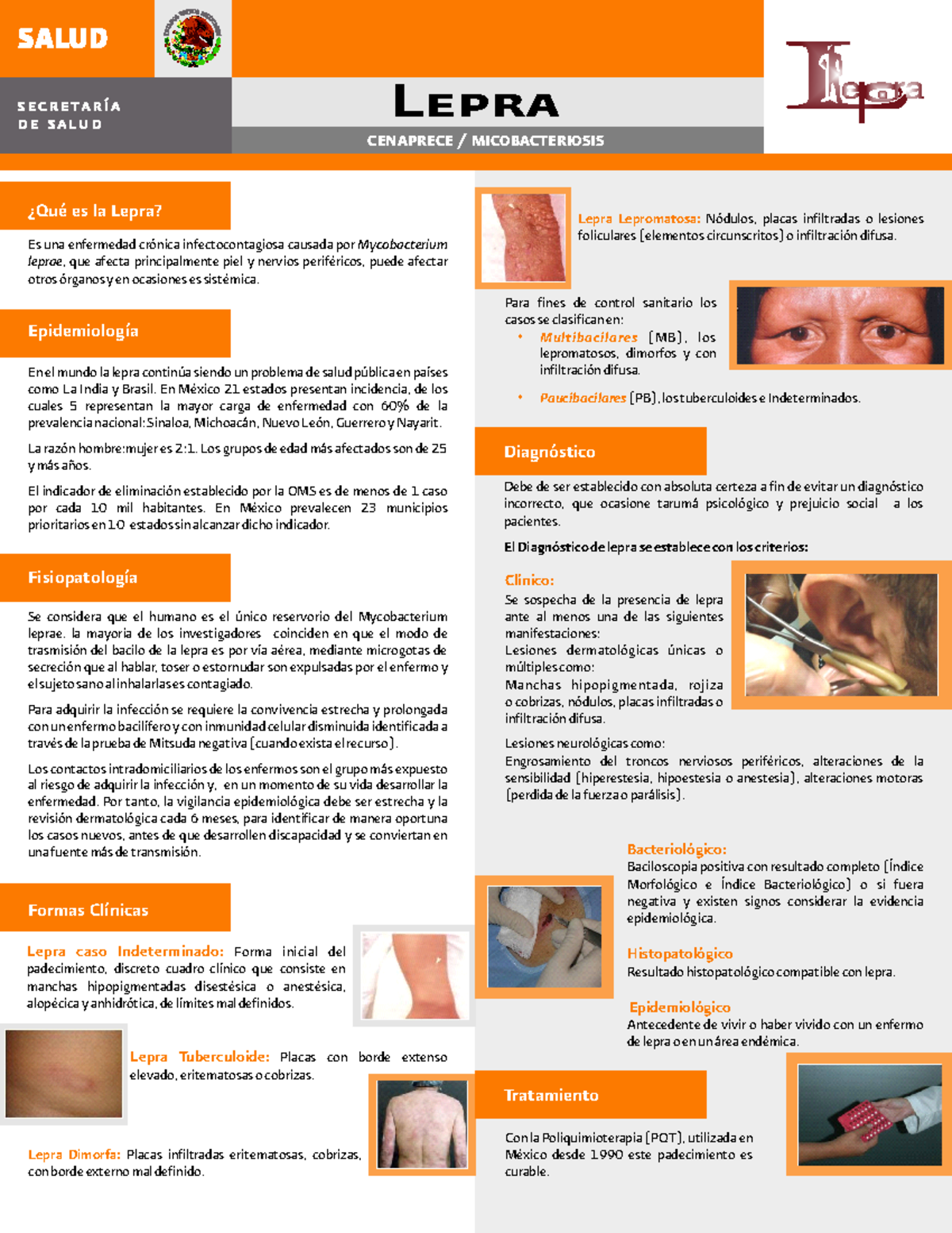 Lepra - Informacion - Lepra ¿Qué es la Lepra? Es una enfermedad crónica ...