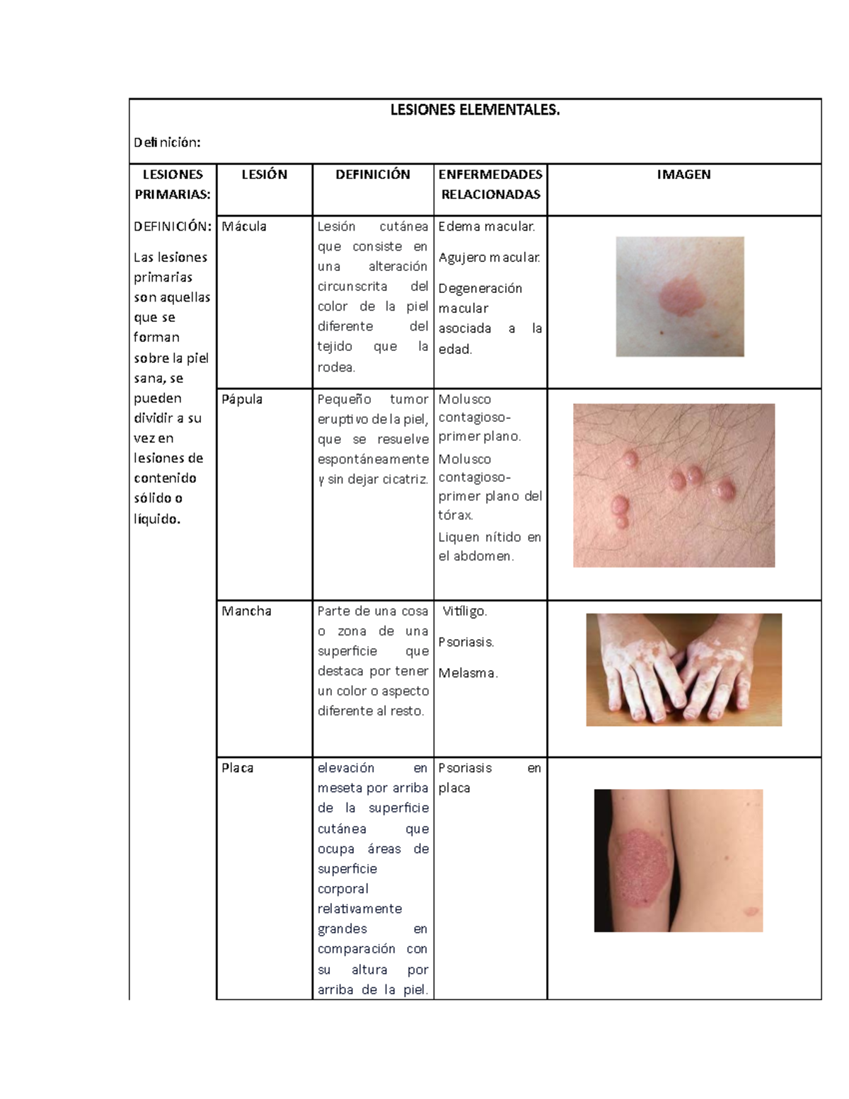 Tabla PM - mnmnmn - LESIONES ELEMENTALES. Definición: LESIONES ...