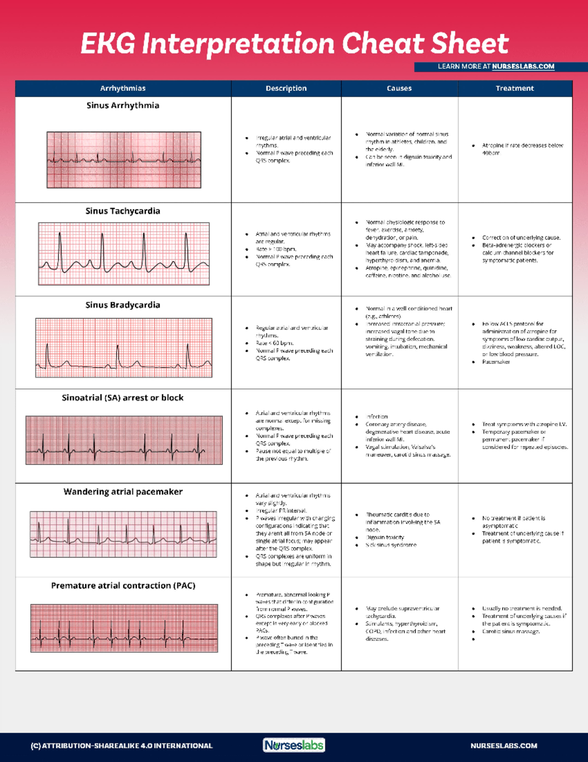 EKG 1 - Practice Material - BIO 113 - Studocu