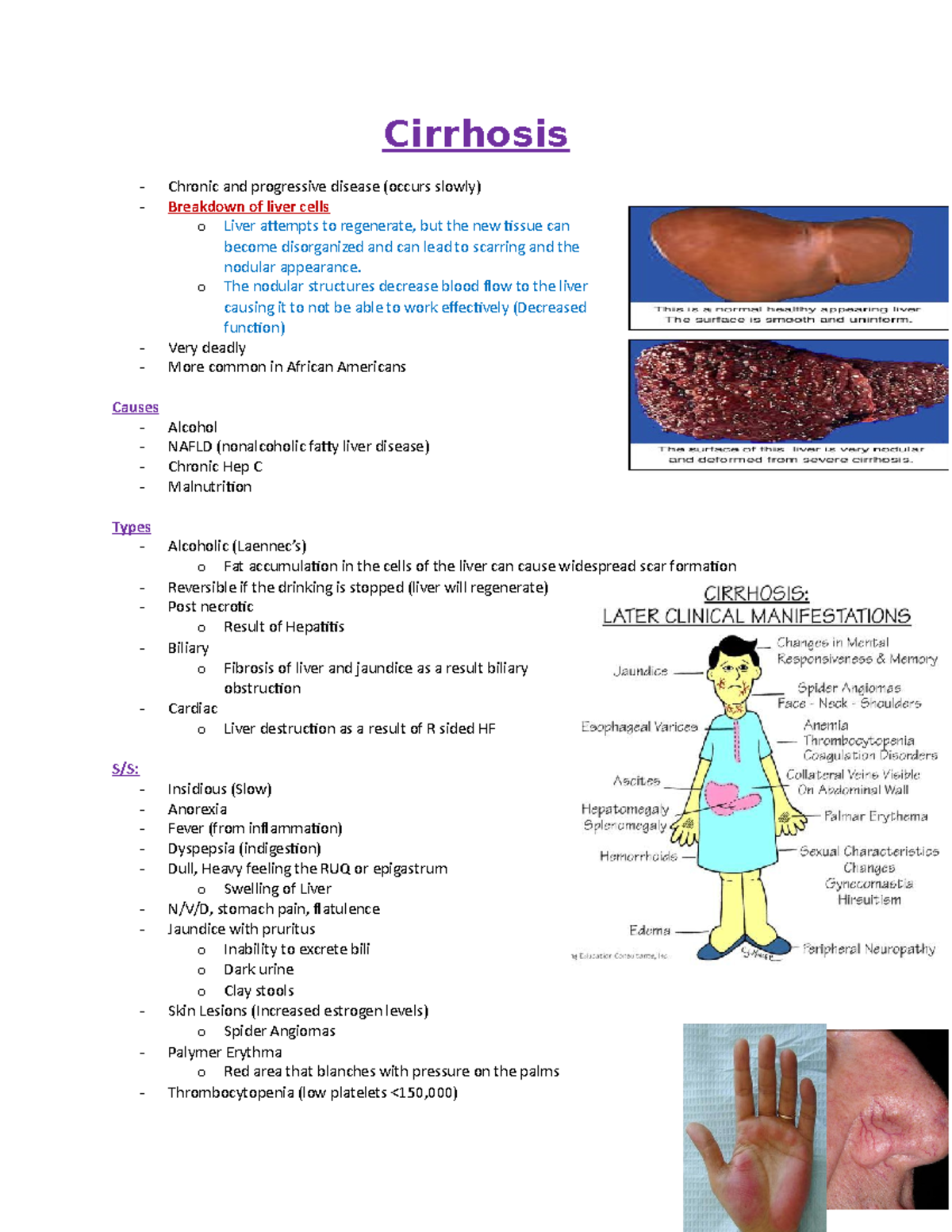 Cirrhosis- notes - bridge program med surg 2 - Cirrhosis Chronic and ...