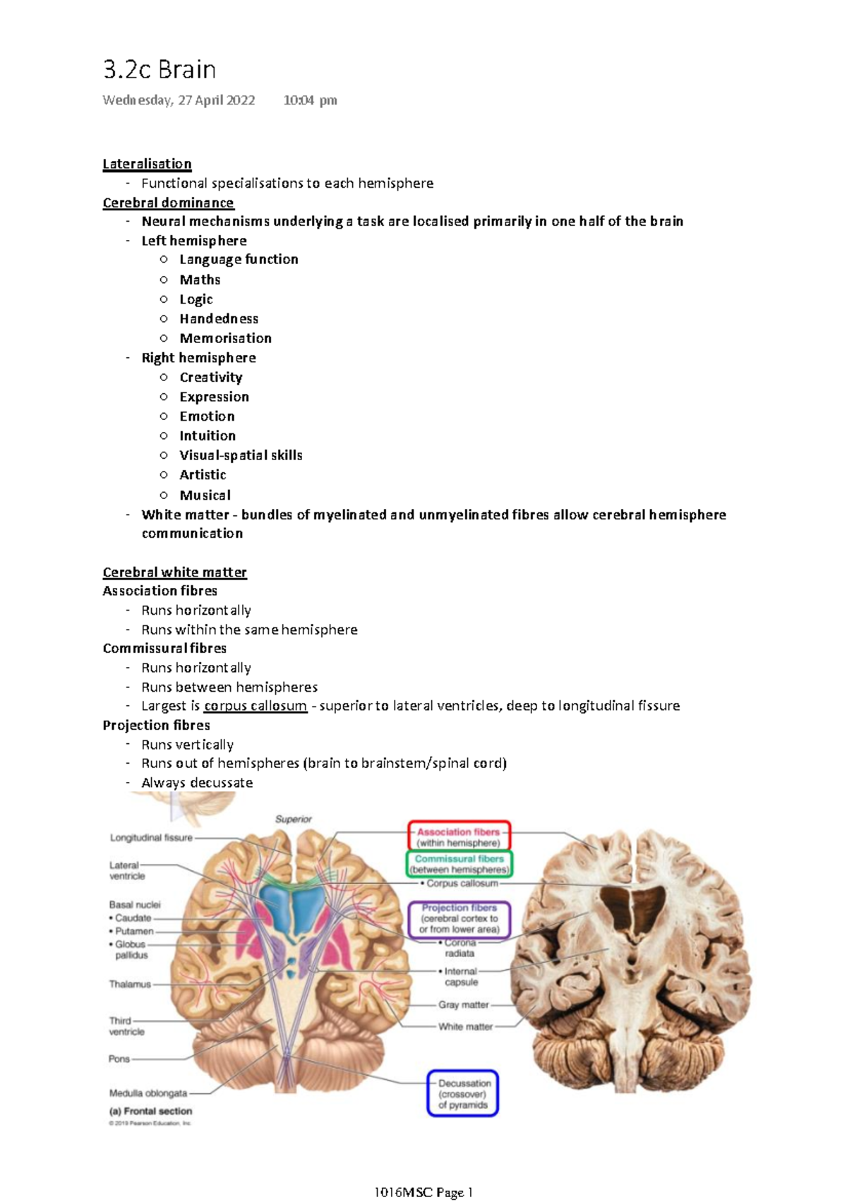 3.2c Brain - Lateralisation - Functional specialisations to each ...