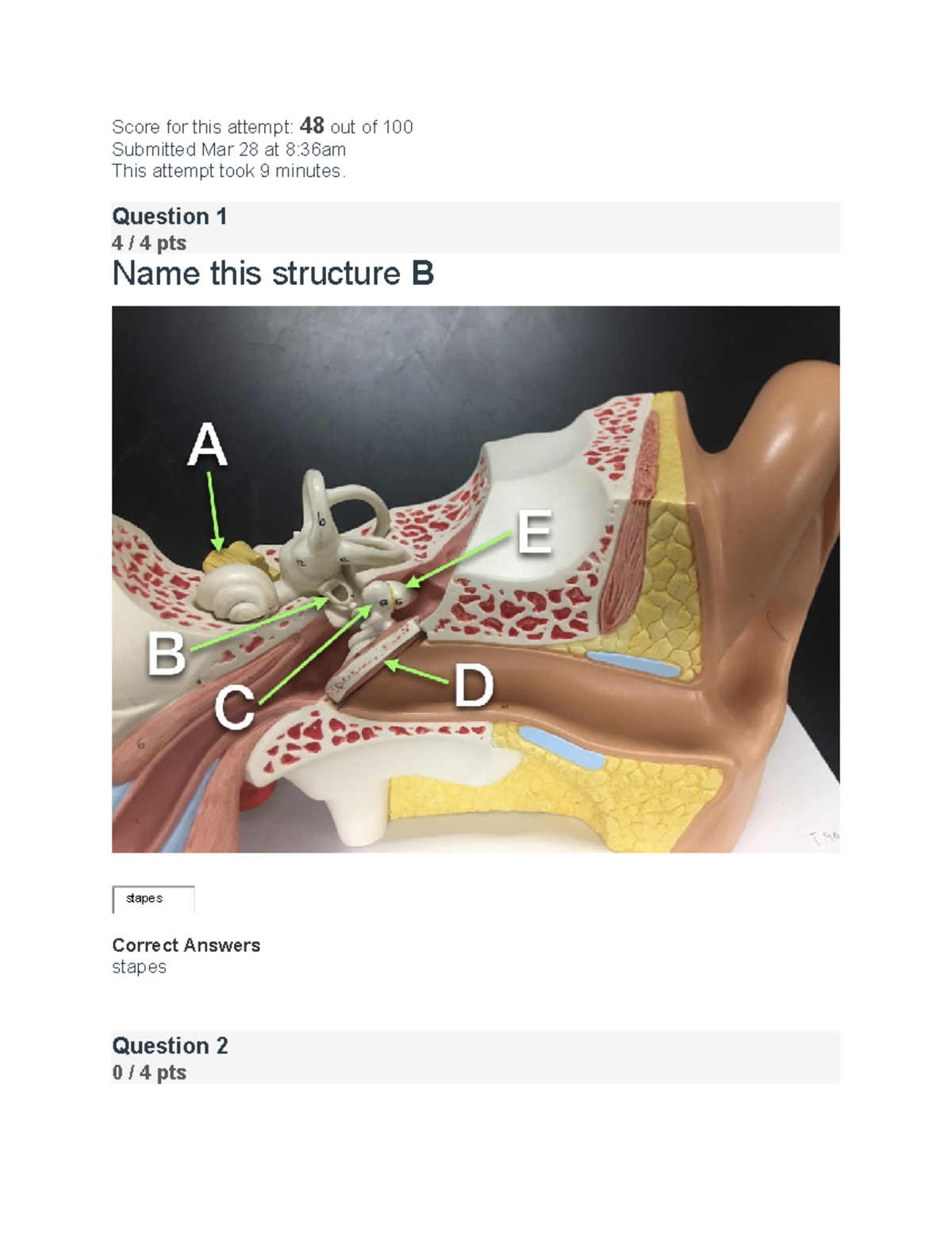 Ch. 6 Special senses quiz - Score for this attempt: 48 out of 100 ...