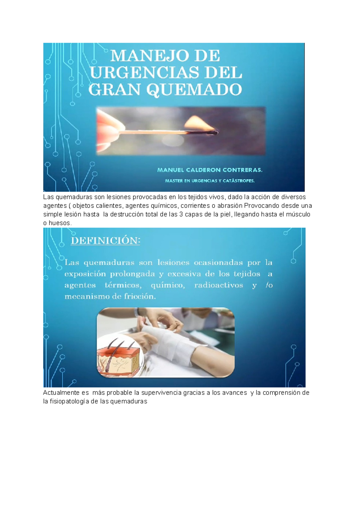 Manejo de urgencias del gran quemado - Las quemaduras son lesiones ...