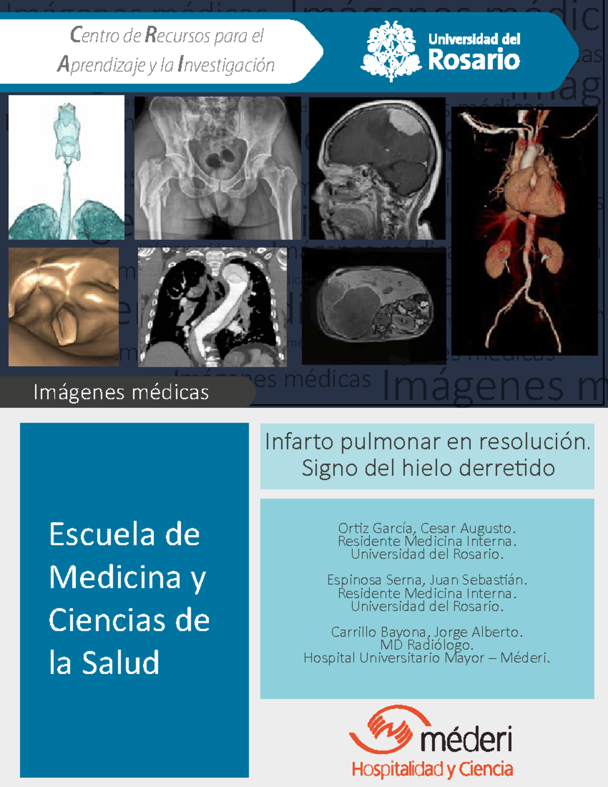 Infarto pulmonar - Es bueno - Imágenes médicas Imágenes médicas ...
