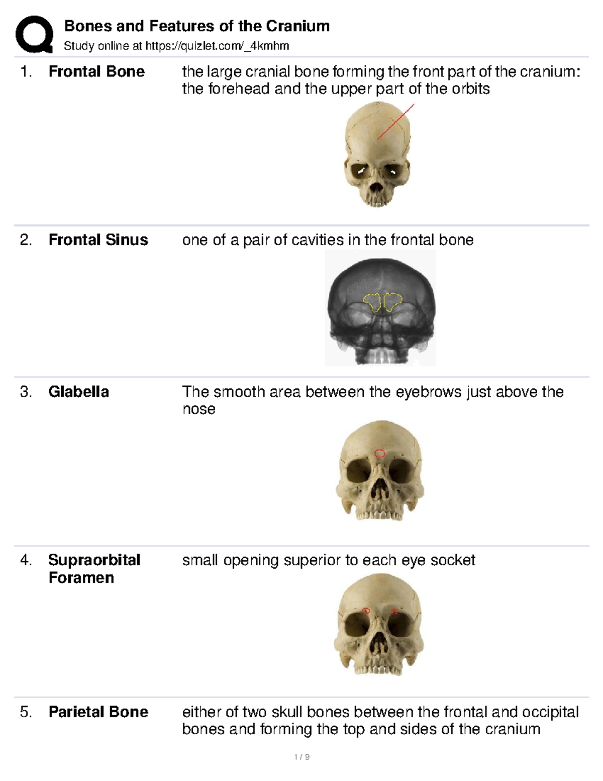 POSI-P3- Quizlet 2 - Bhjhhhjjj - Bones and Features of the Cranium ...