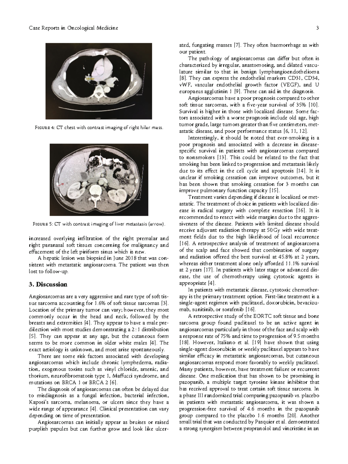 Angiosarcoma of the face a case study 2 - increased overlying ...