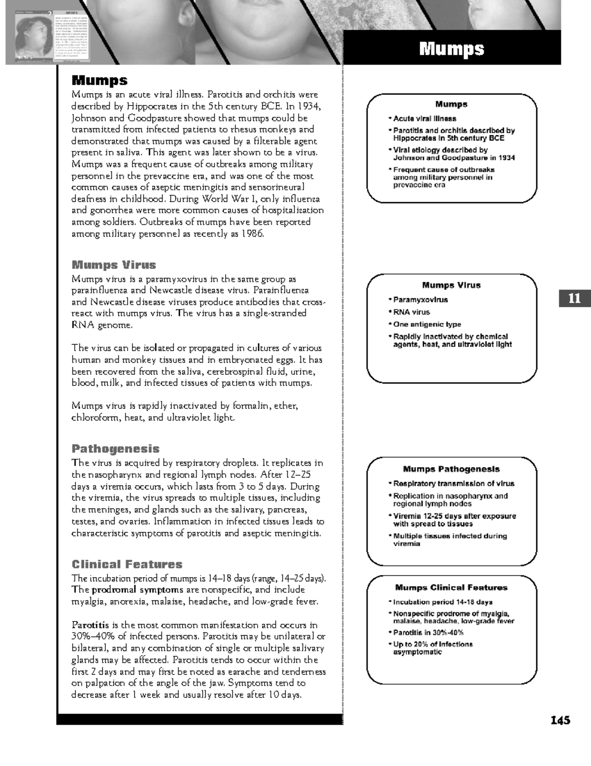 Mumps info - 11 Mumps Mumps is an acute viral illness. Parotitis and ...