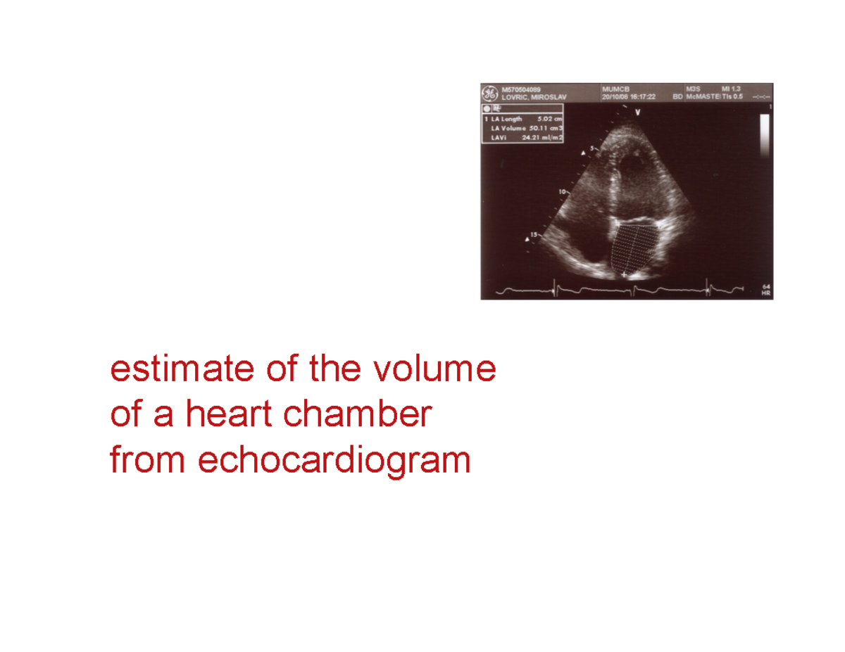 Volume of heart - estimate of the volume of a heart chamber from ...