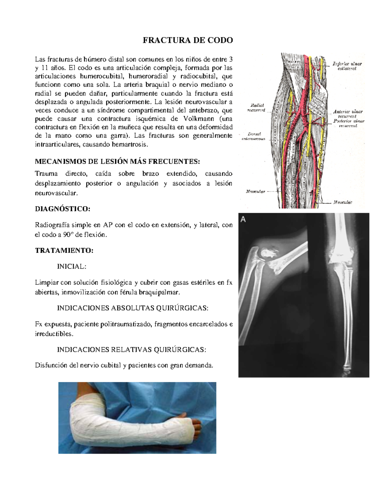 Fractura DE CODO - Warning: TT: undefined function: 32 FRACTURA DE CODO Las fracturas de húmero ...
