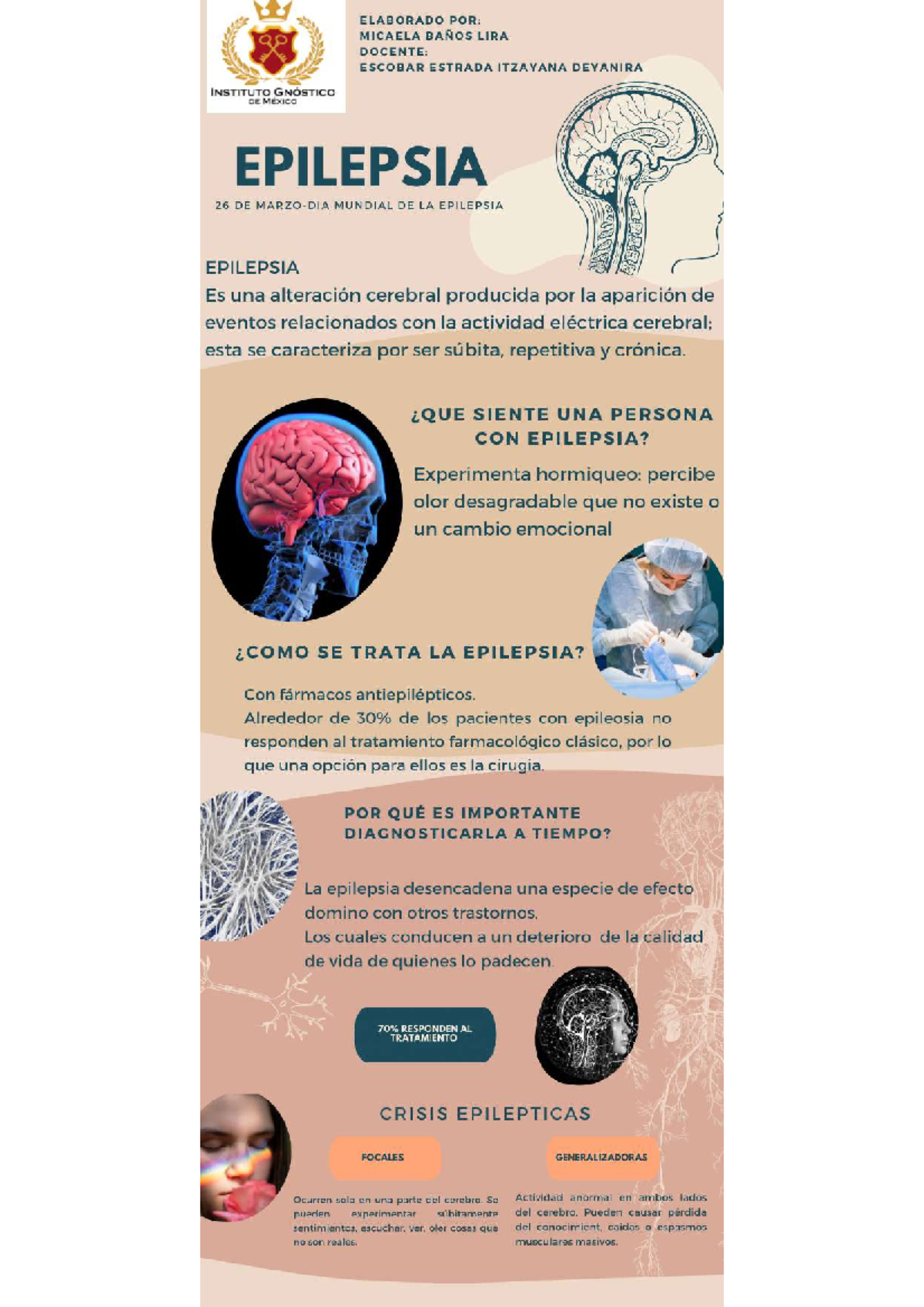 Epilepsia …………. - Anatomia humana - Studocu