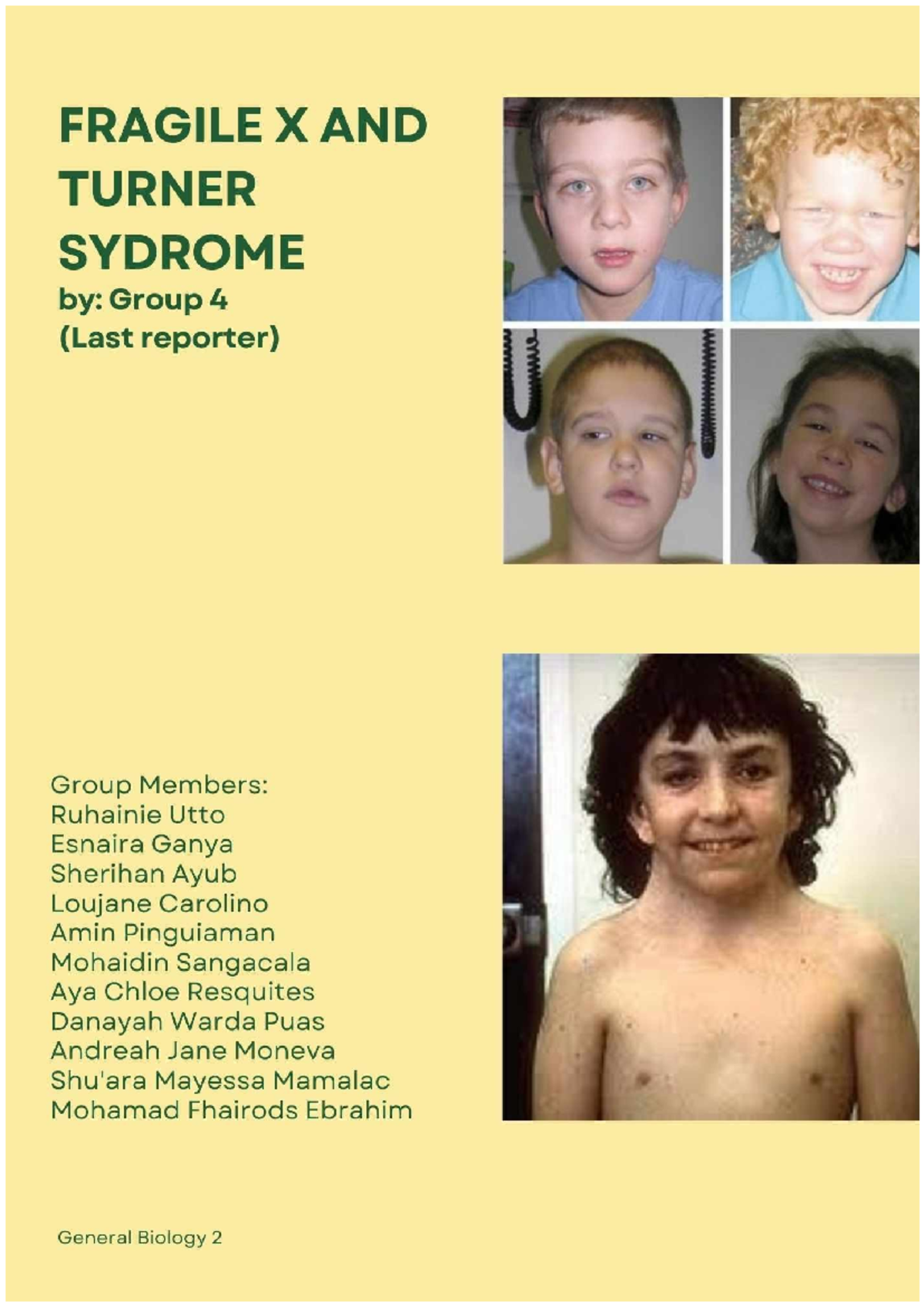 Fragile X AND Turner Syndrome Report Group 4 - FRAGILE X SYMPTOMS While ...
