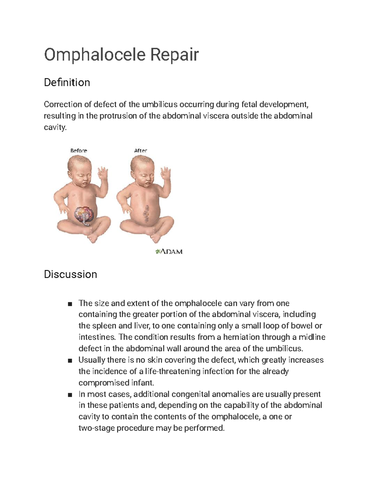 Omphalocele Repair - Carmines - Omphalocele Repair Definition ...