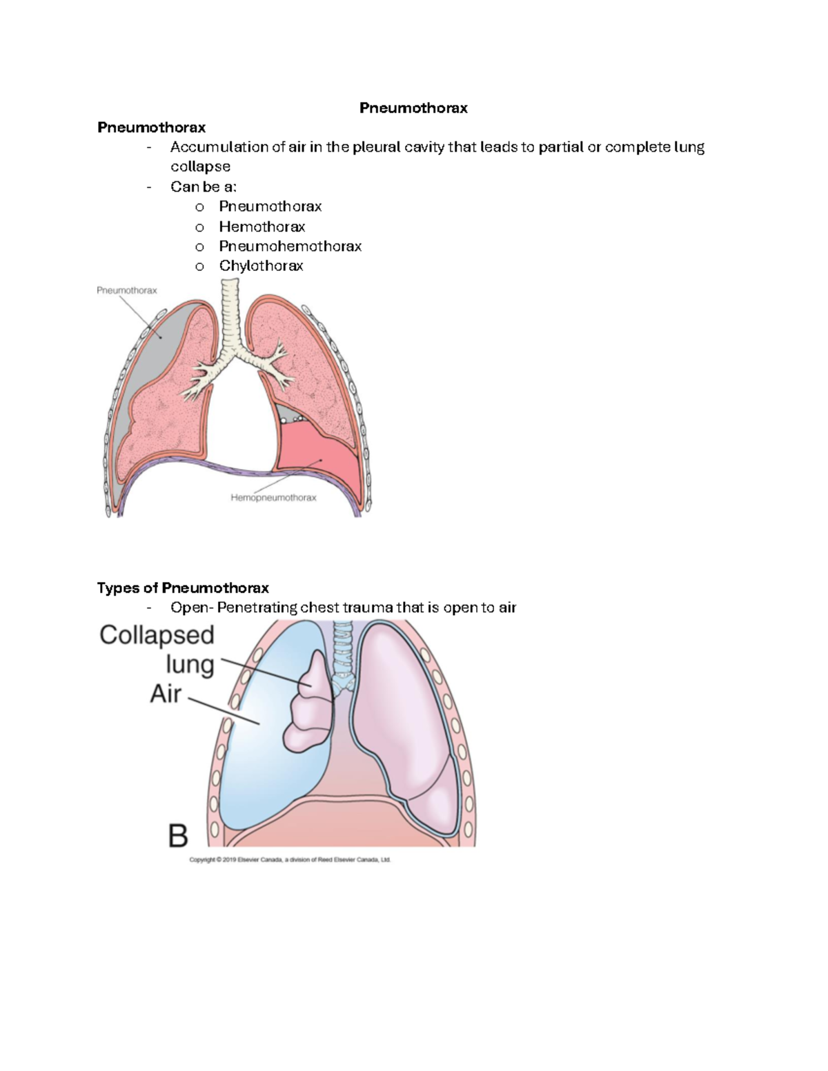 Pneumothorax - pneumothoarax - Nurs 311.3 - Pneumothorax Pneumothorax Accumulation of air in the ...