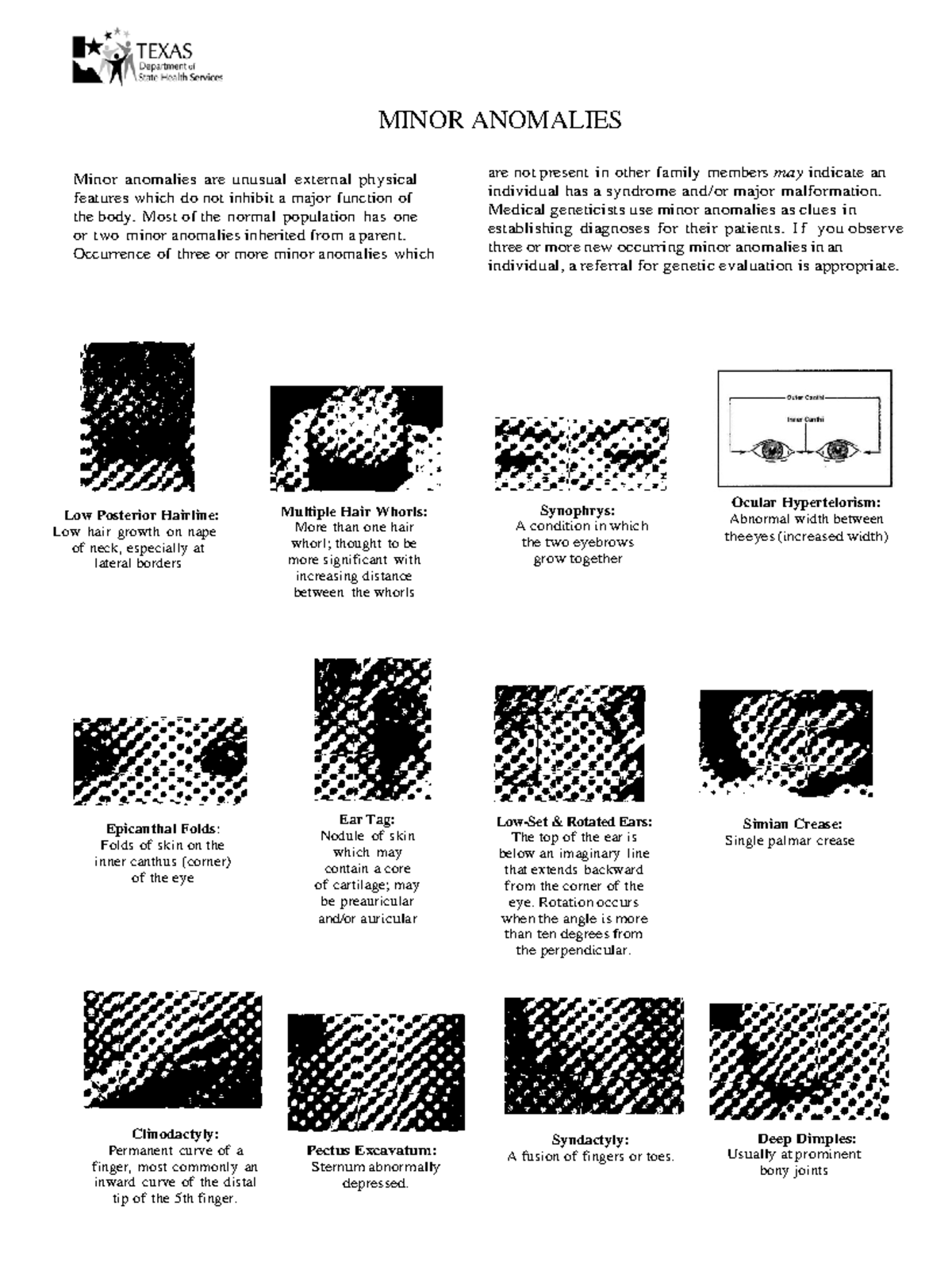 L1 anoma - genetic - MINOR ANOMALIES Minor anomalies are unusual ...