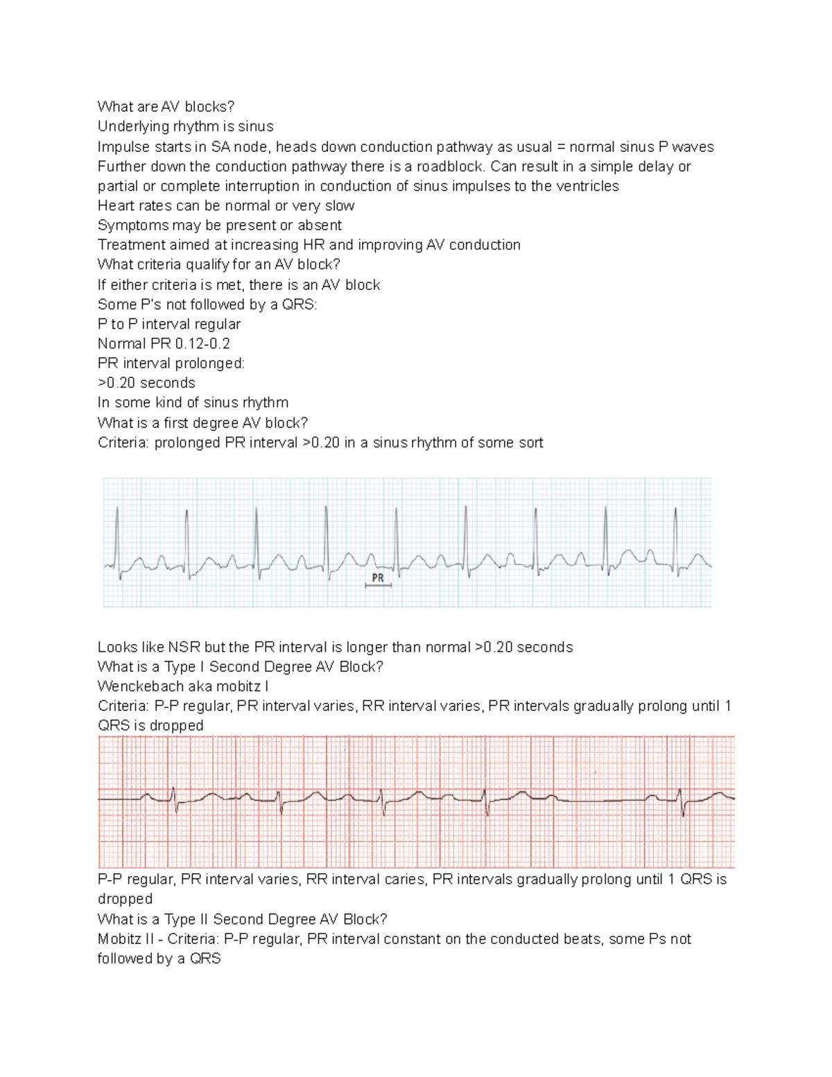 N420 AV Heart Blocks - Critical care notes Dr. Godshall - What are AV ...