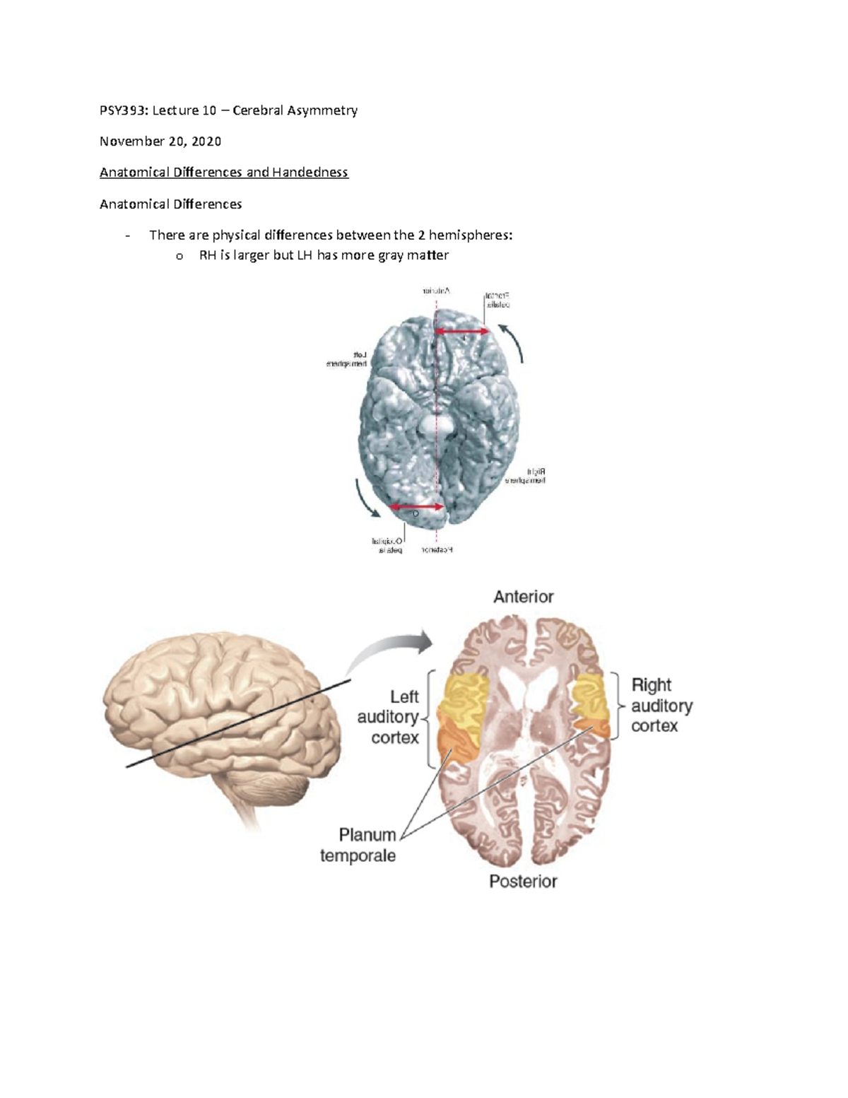 PSY393 - Lecture 8 - Cerebral asymmetry - PSY393: Lecture 10 – Cerebral ...