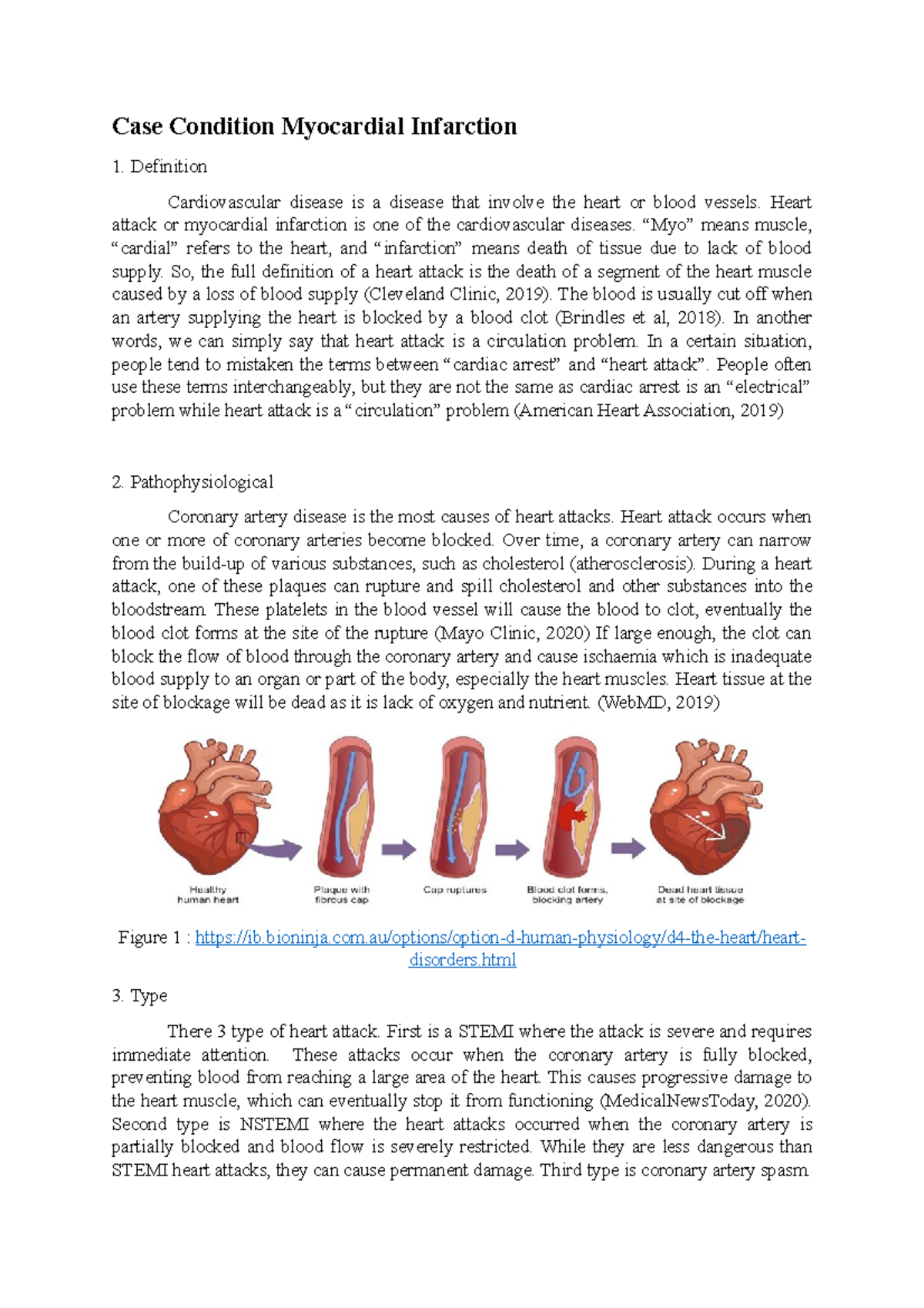Case Condition Myocardia Infarction - Case Condition Myocardial ...